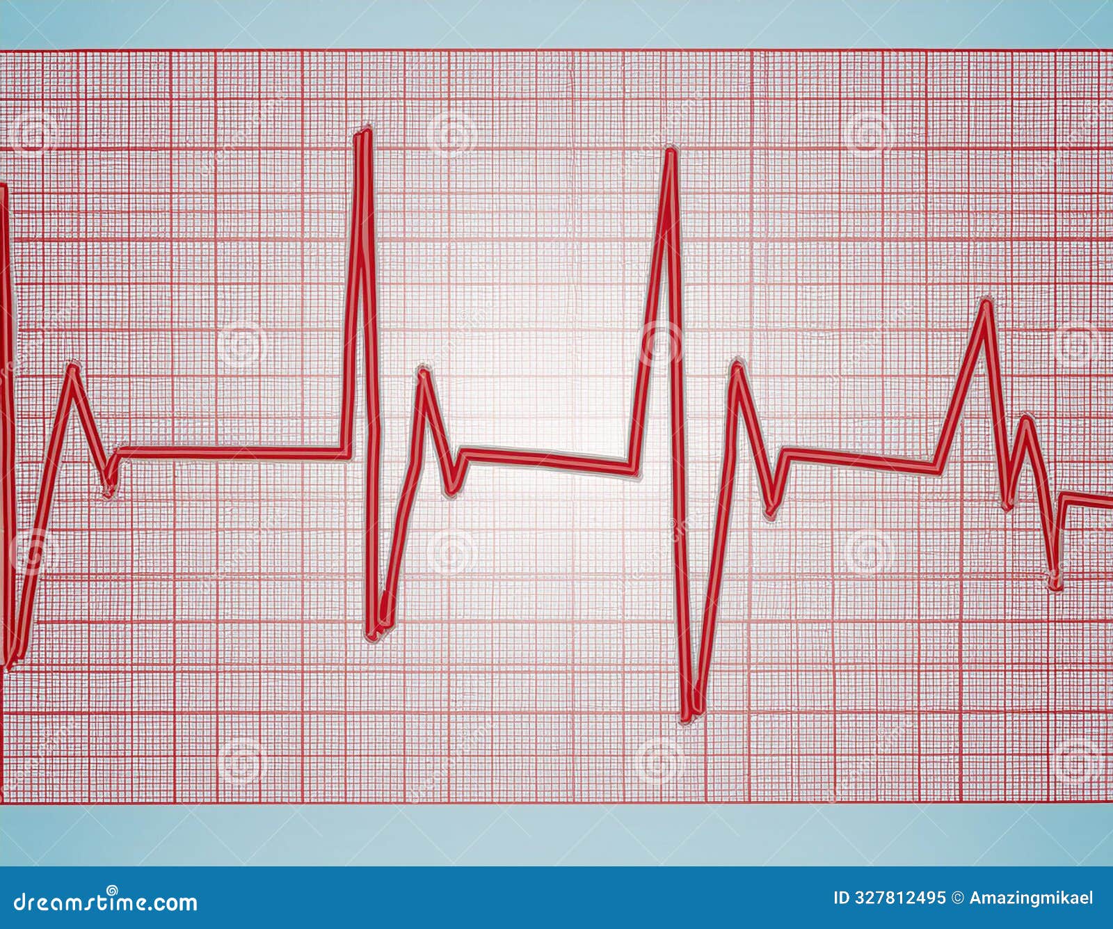 Pulse Wave Doppler Ultrasound Examination. Stock Image | CartoonDealer ...