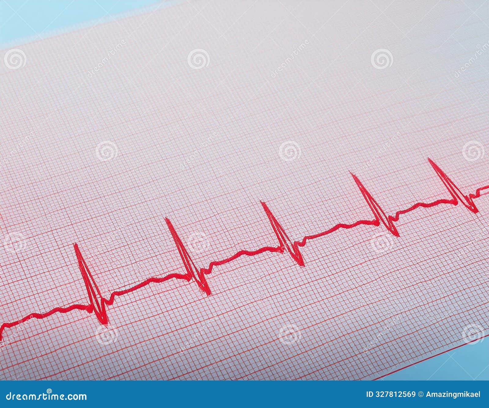Pulse Wave Doppler Ultrasound Examination. Stock Image | CartoonDealer ...