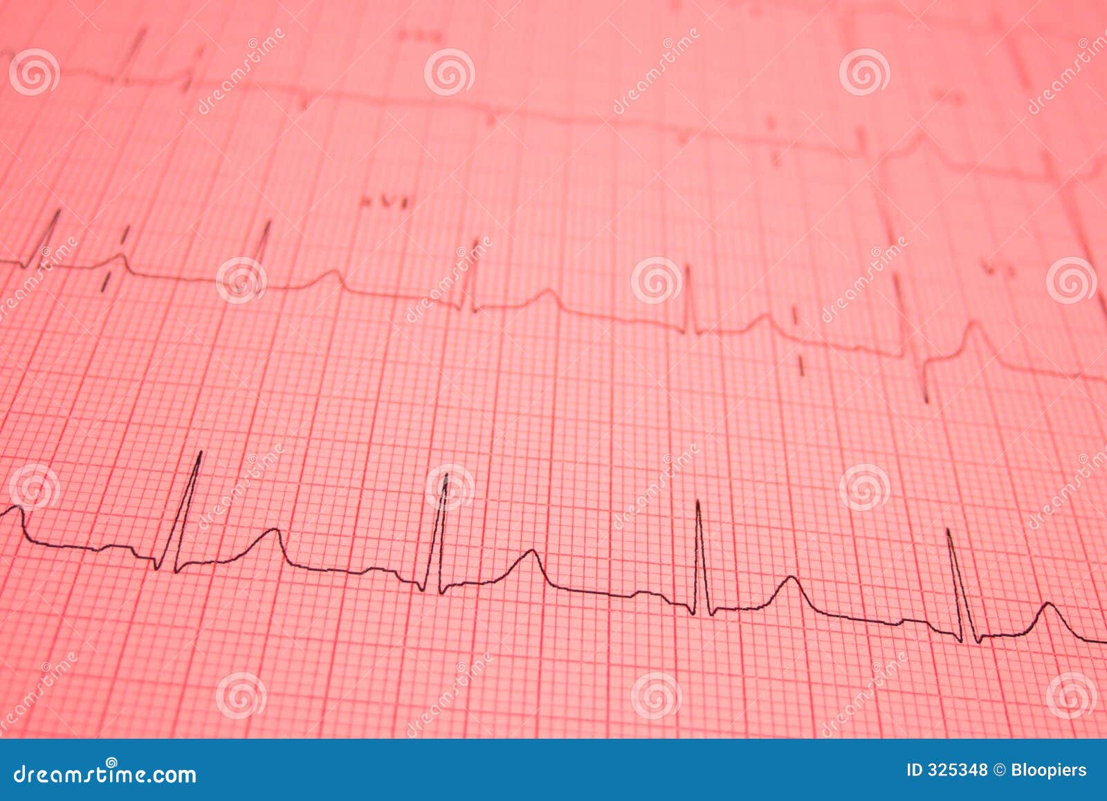ECG red stock photo. Image of diagnosis, limits, cardiac - 325348