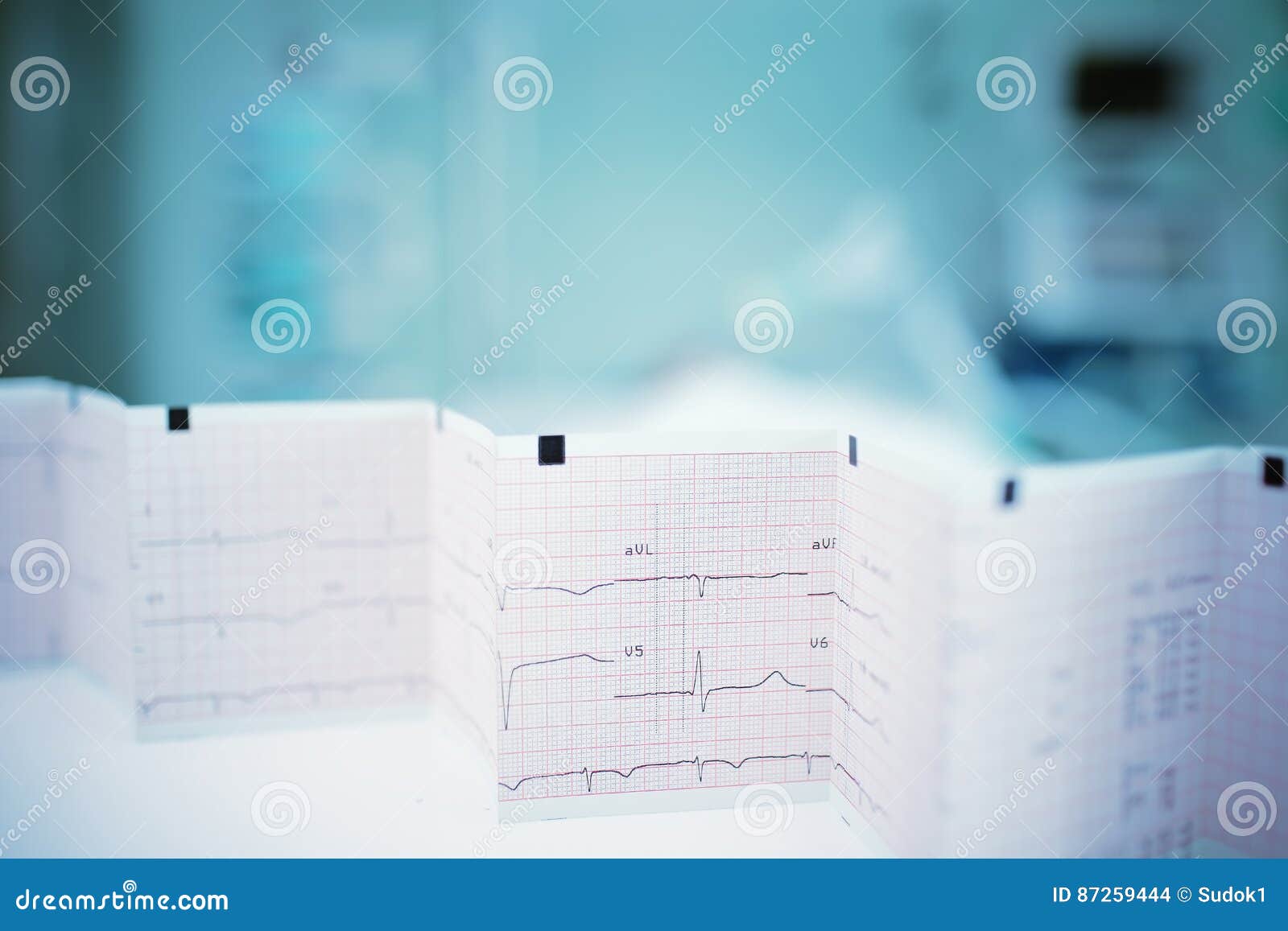 ECG on the Table in Hospital Ward Stock Photo - Image of cardiogram ...