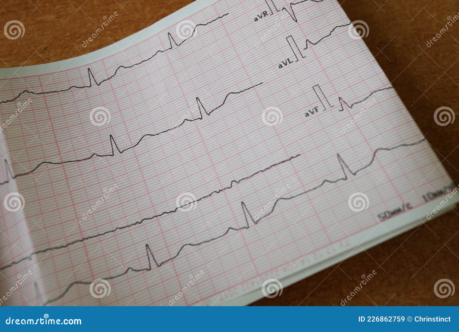 An ecg tape stock image. Image of pattern, tape, line - 226862759