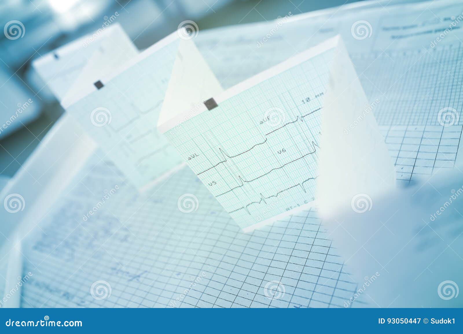 ECG-tape Against the Backdrop of the Hospital Ward Stock Image - Image ...