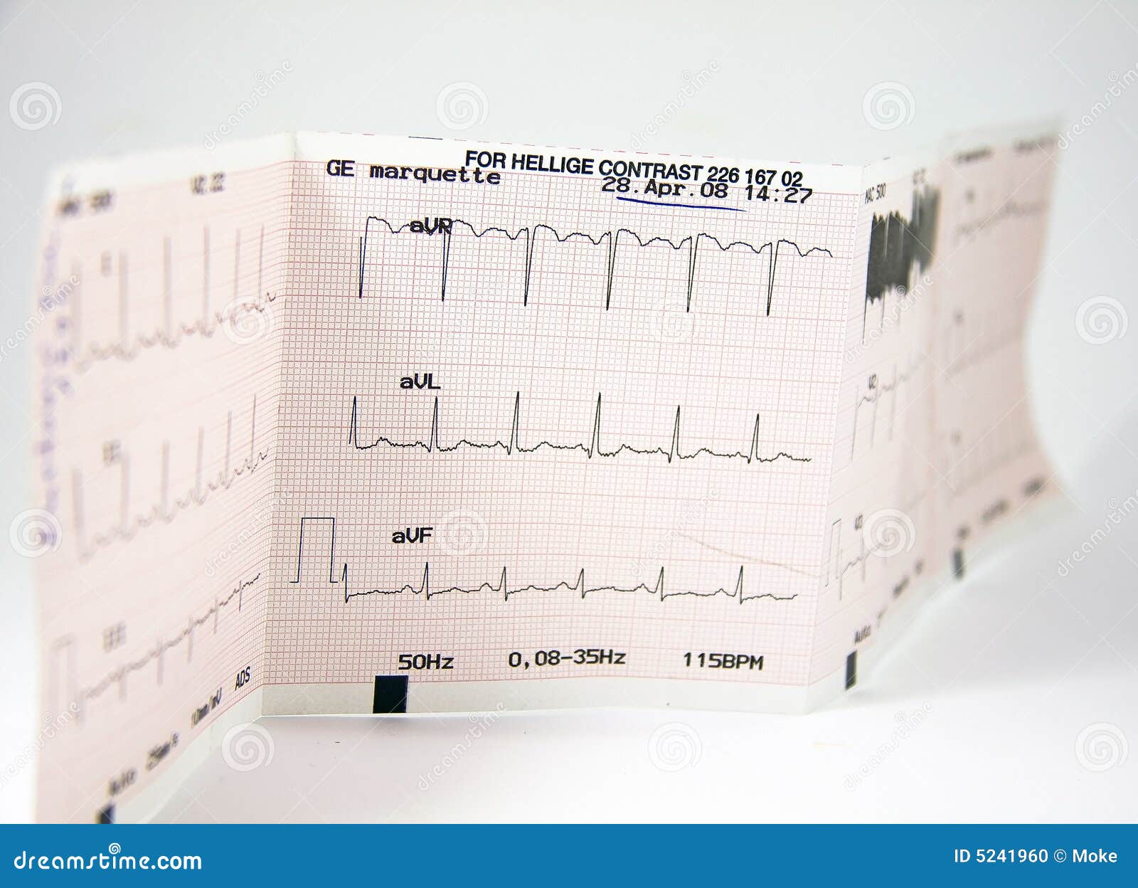 Ecg Test stock photo. Image of graph, graphic, cardiology - 5241960