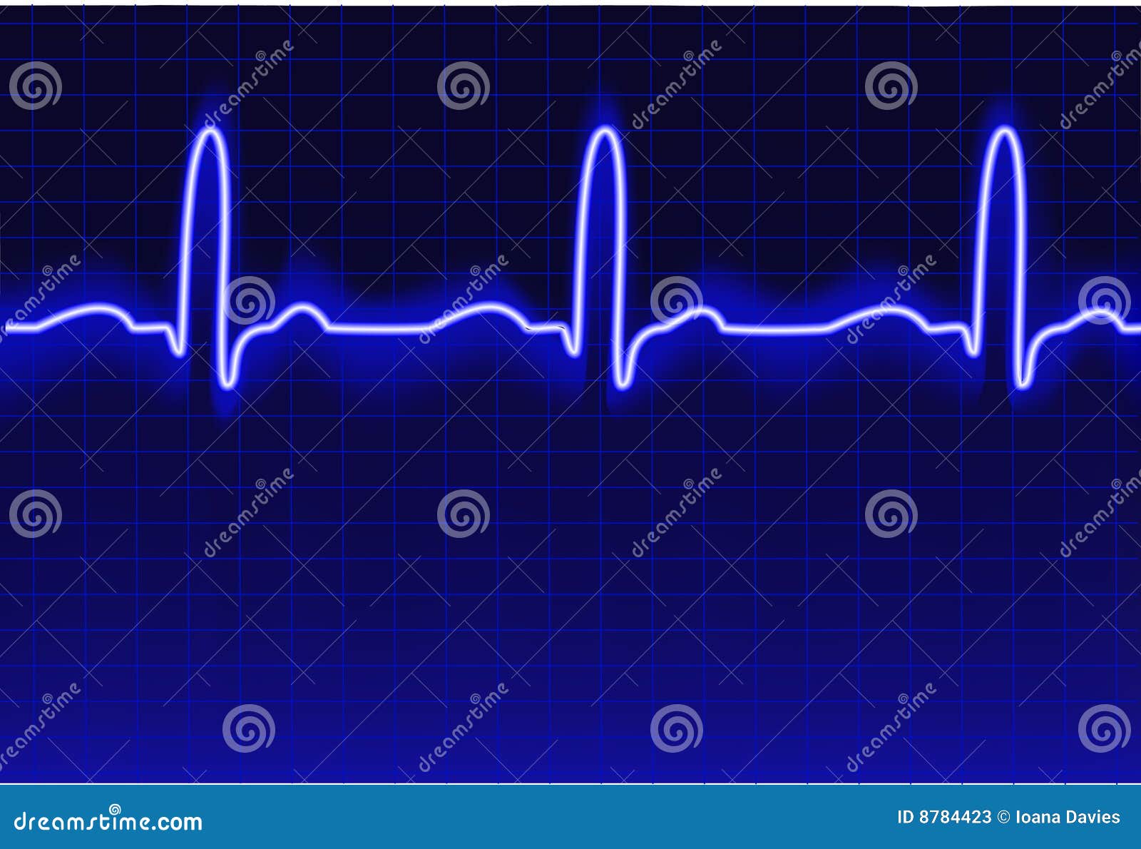 ECG trace stock vector. Illustration of abstract, heart - 8784423