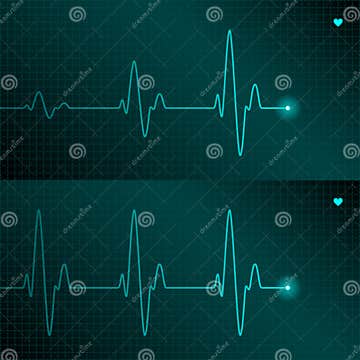 ECG tracing stock vector. Illustration of medicine, science - 11569965
