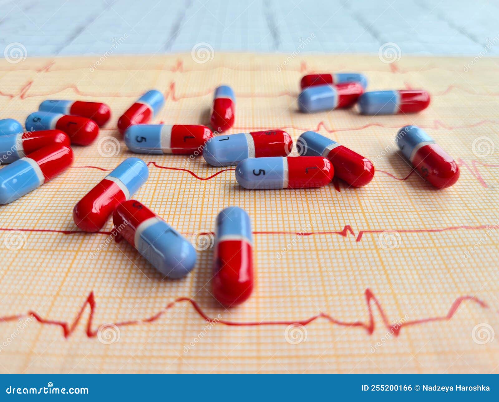 ECG with Ventricular Pacing Rhythm of Artificial Pacemaker with Pills ...