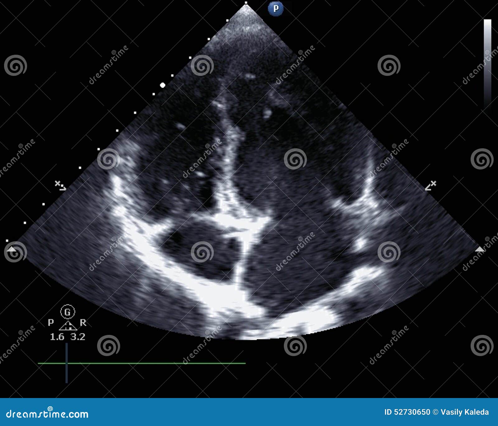 Echocardiogram stock foto. Image of cardiologie, tussenschot - 52730650