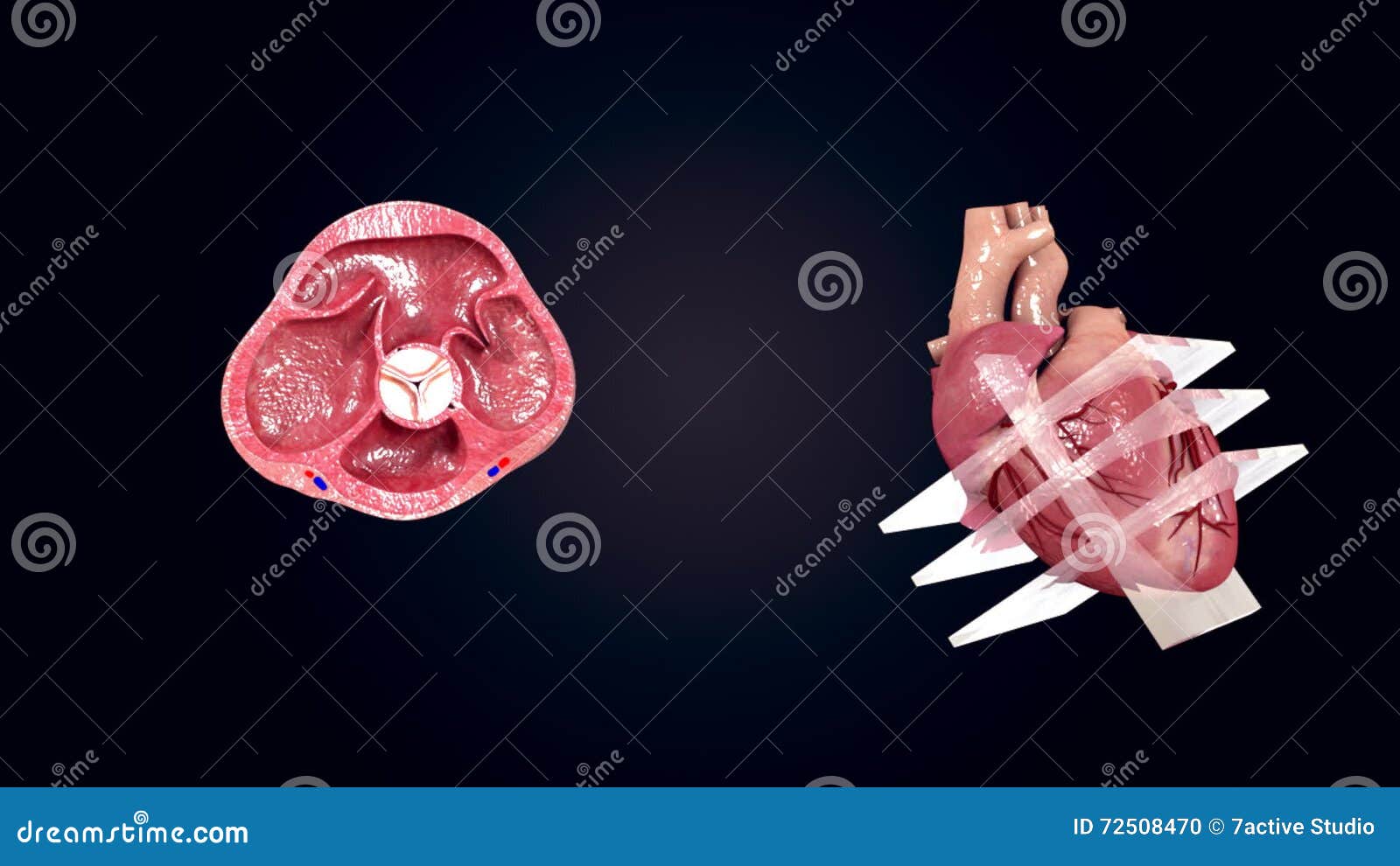 Echocardiogram Cartoons, Illustrations & Vector Stock Images - 324 ...