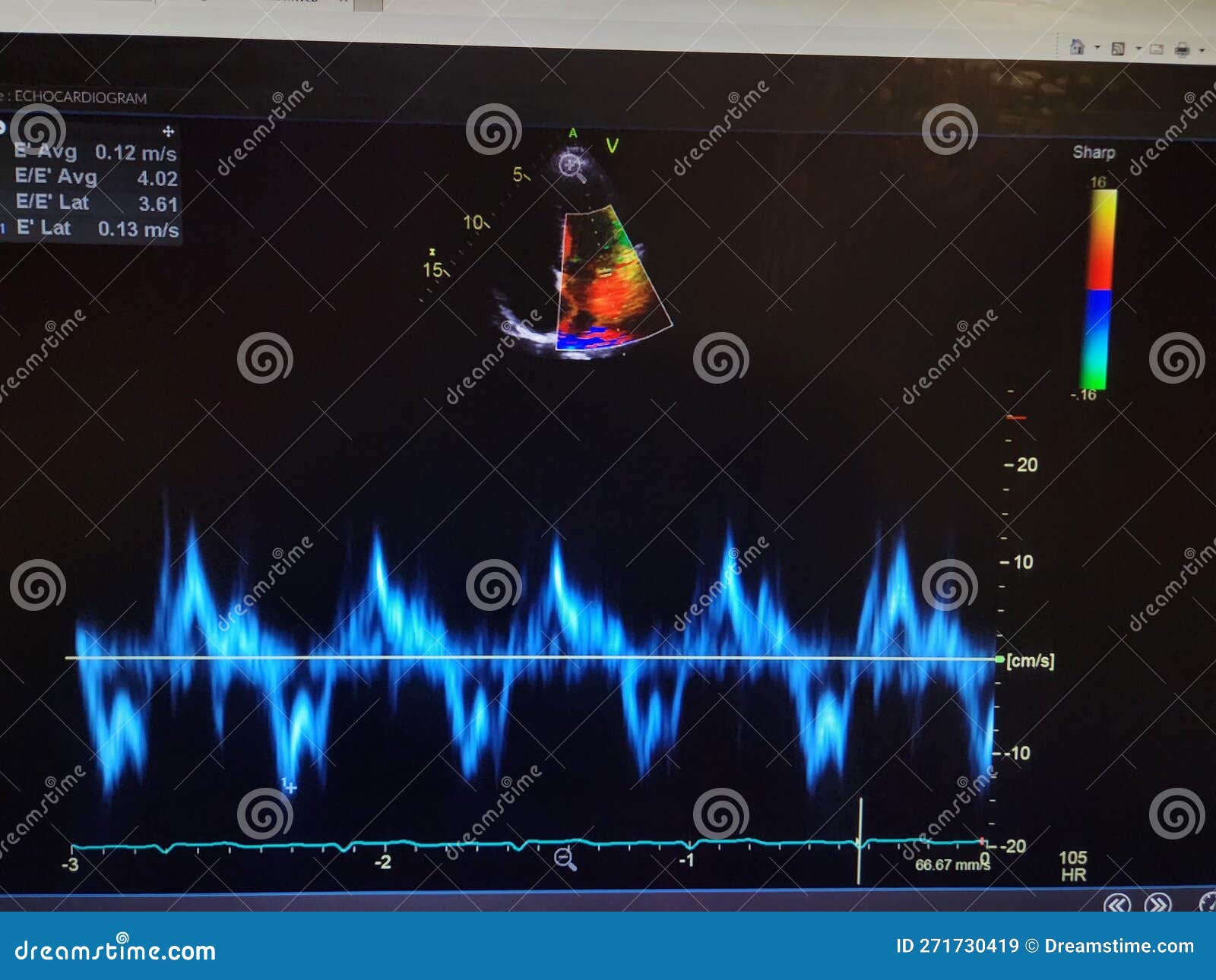 Echocardiogram Colorful Probe Targeting Map and Waveforms Stock Image ...