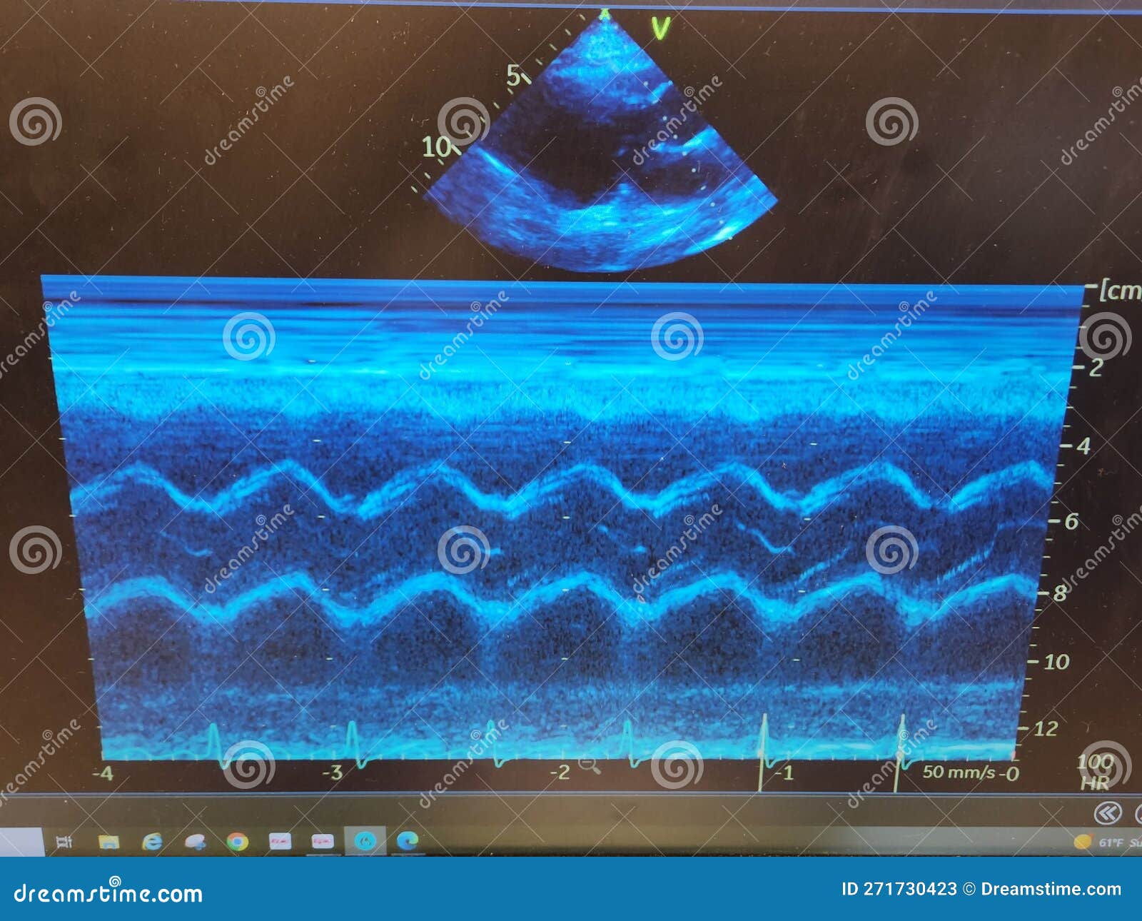 Echocardiogram Colorful Probe Targeting Map And Waveforms Royalty-Free ...