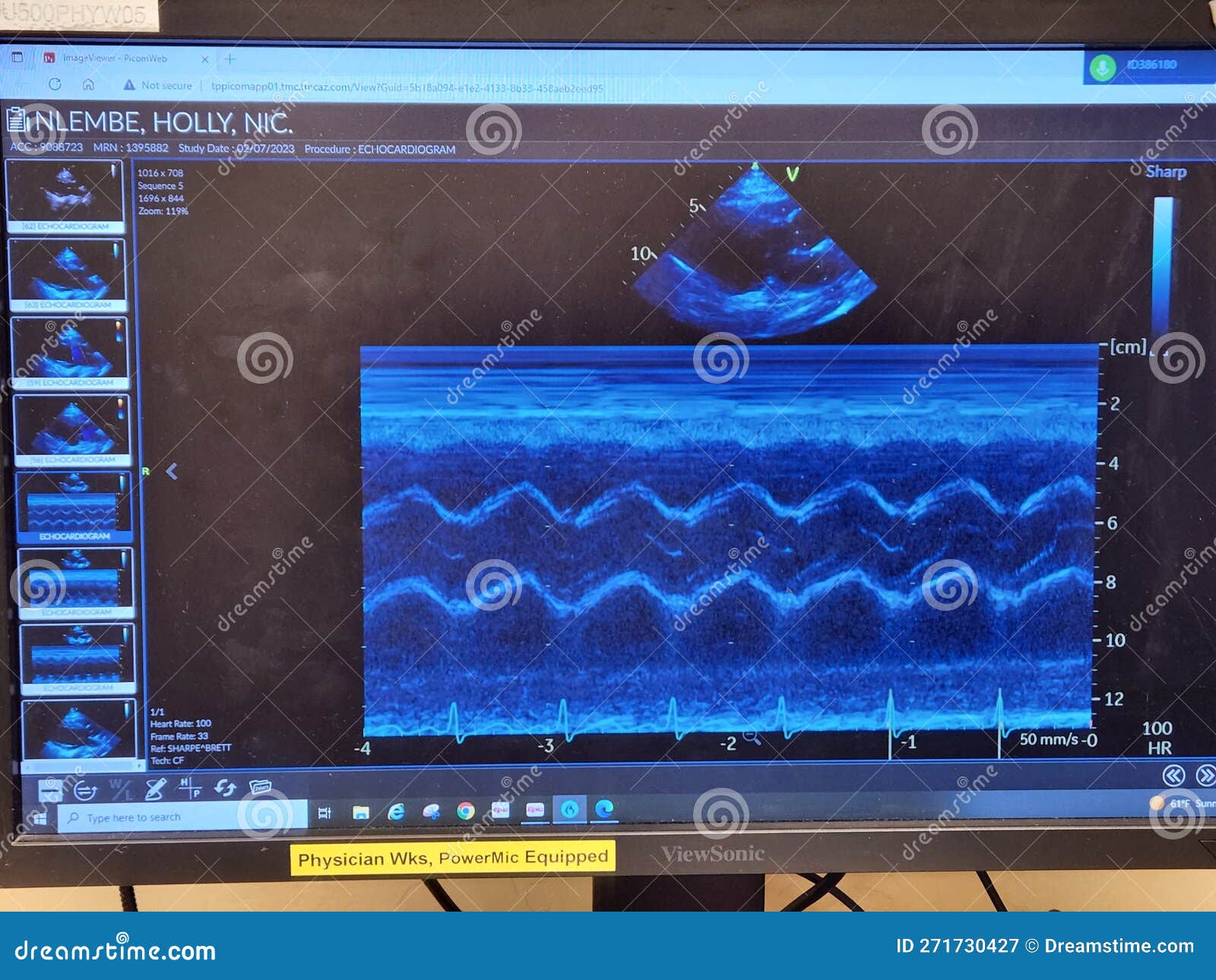 Echocardiogram Colorful Probe Targeting Map And Waveforms Royalty-Free ...