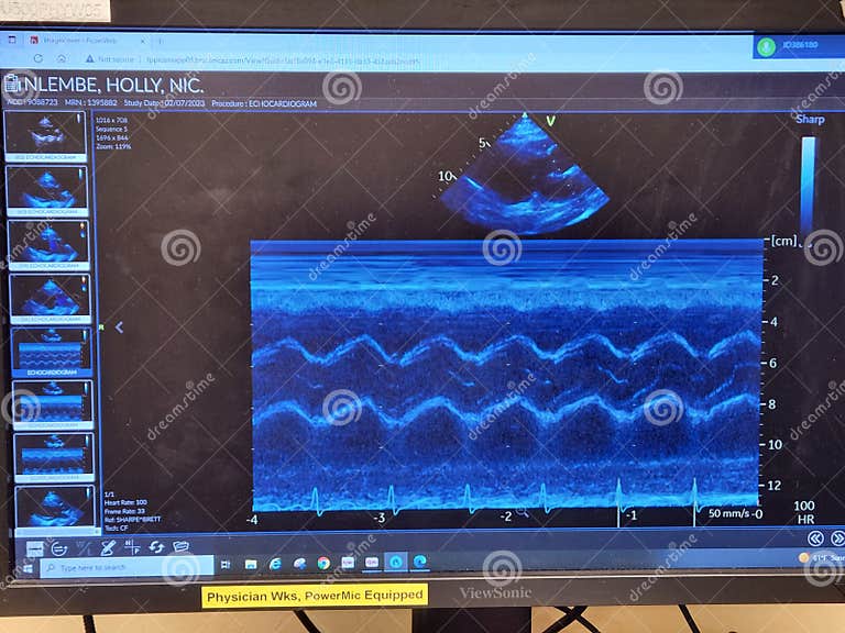 Echocardiogram Colorful Probe Targeting Map and Waveforms Stock Image ...