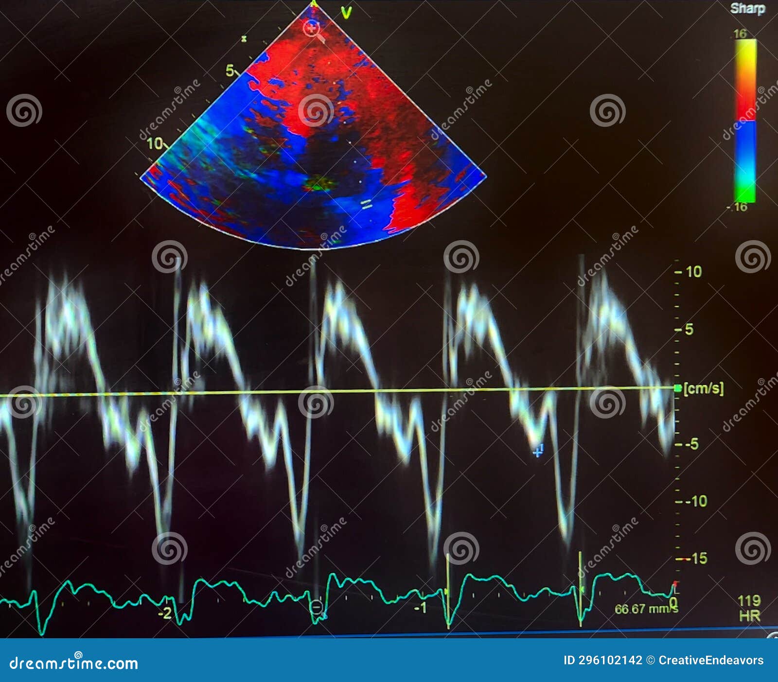 Echocardiogram Colorful Probe Targeting Map And Waveforms Royalty-Free ...