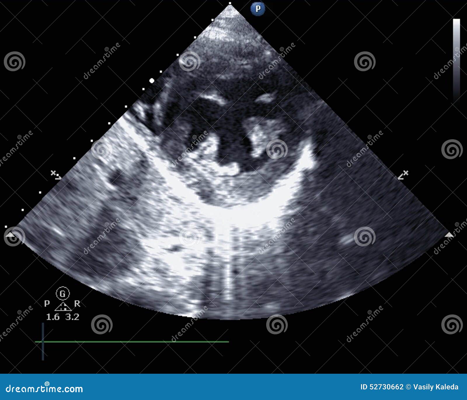 Echocardiogram stock photo. Image of medicine, artery - 52730662