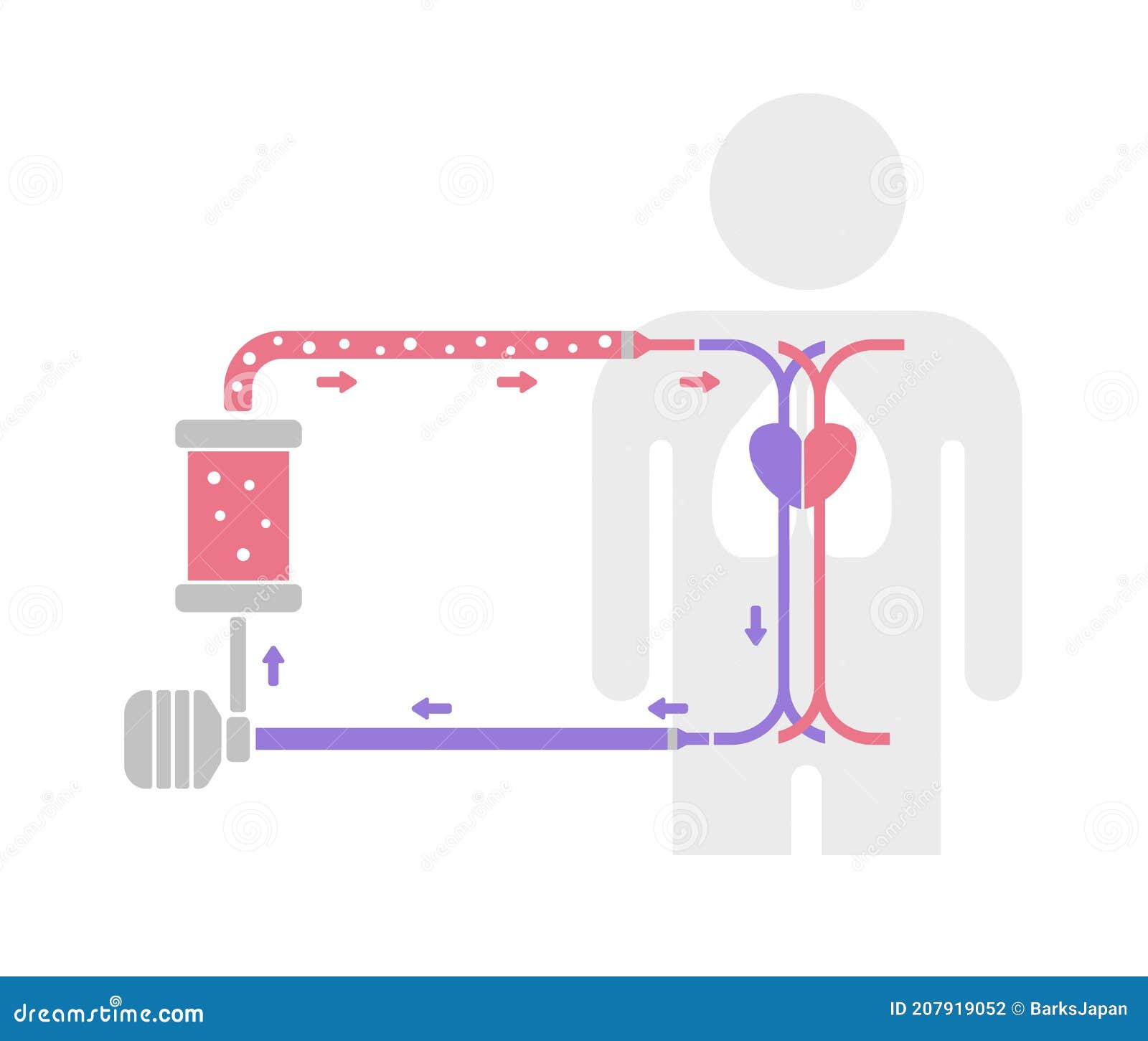ECMO Extracorporeal Membrane Oxygenation Structure Vector Illustration ...