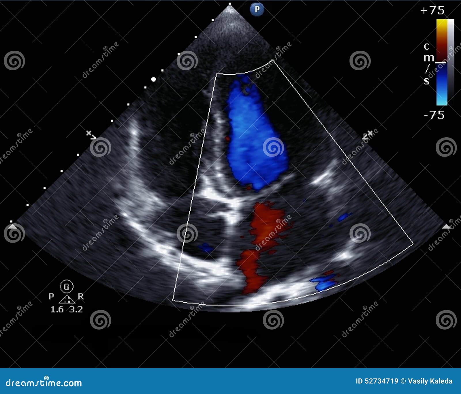 Ecocardiografia di doppler immagine stock. Immagine di medicina - 52734719