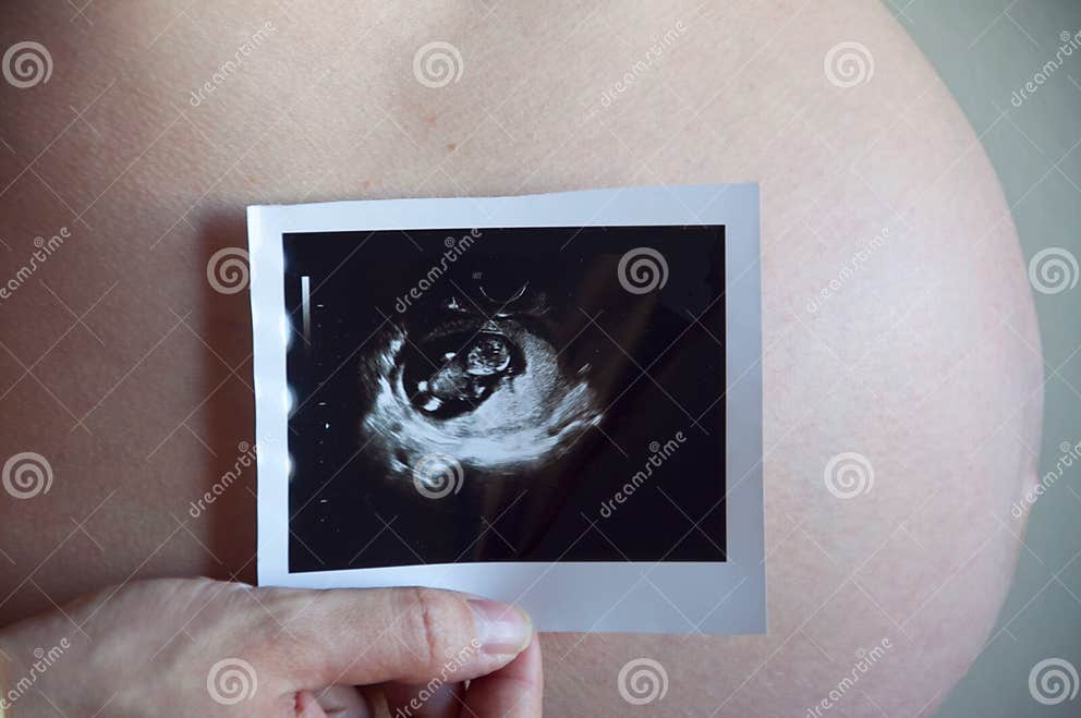 Ecography stock foto. Image of wijfje, zwangerschap, ultrageluid - 48656168