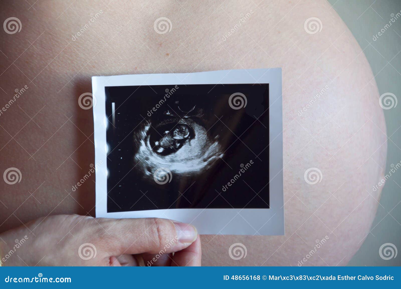 Ecography stock photo. Image of female, pregnant, ecography - 48656168