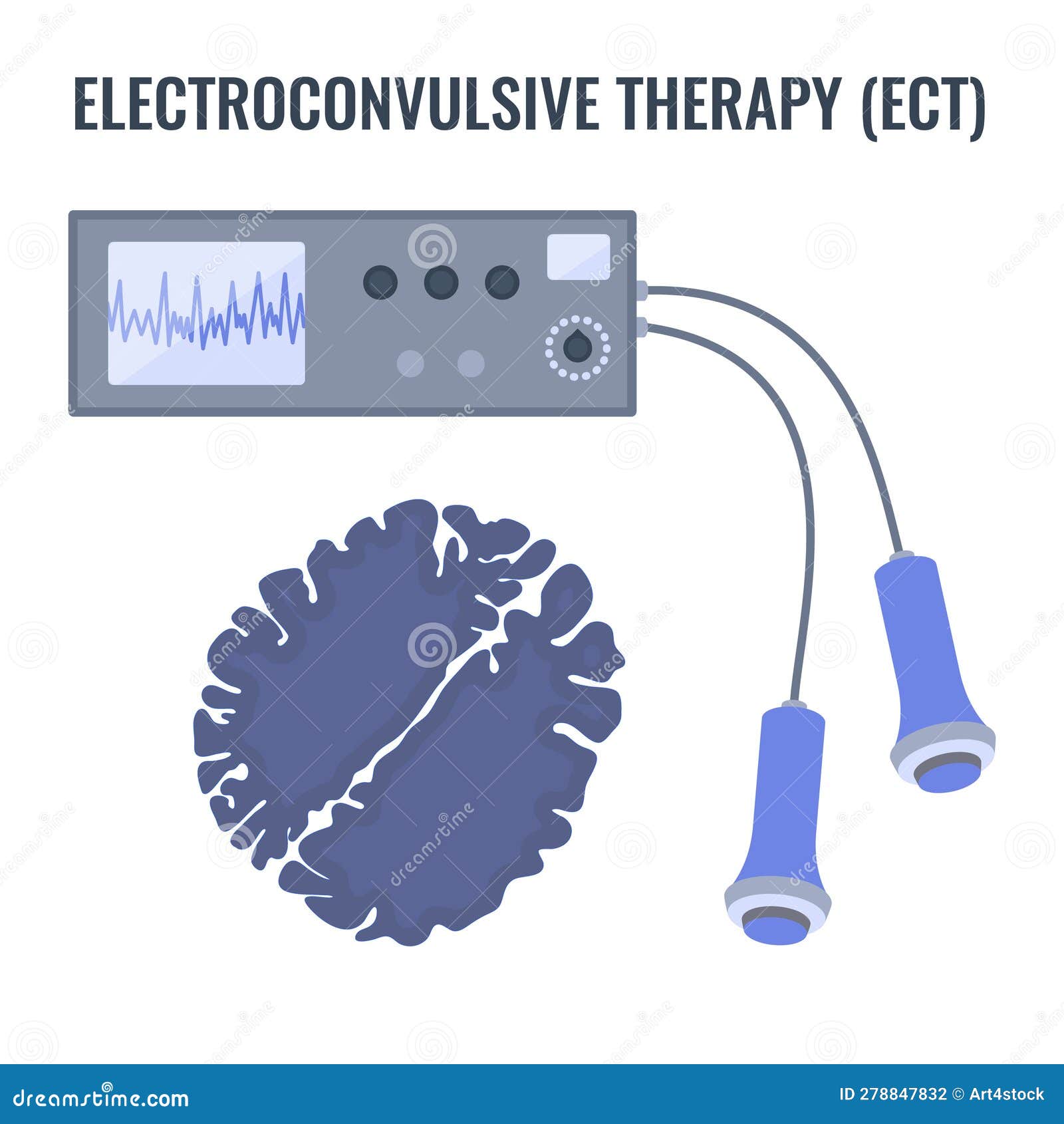 ECT Electroconvulsive Therapy for Severe Depression Treatment Stock ...