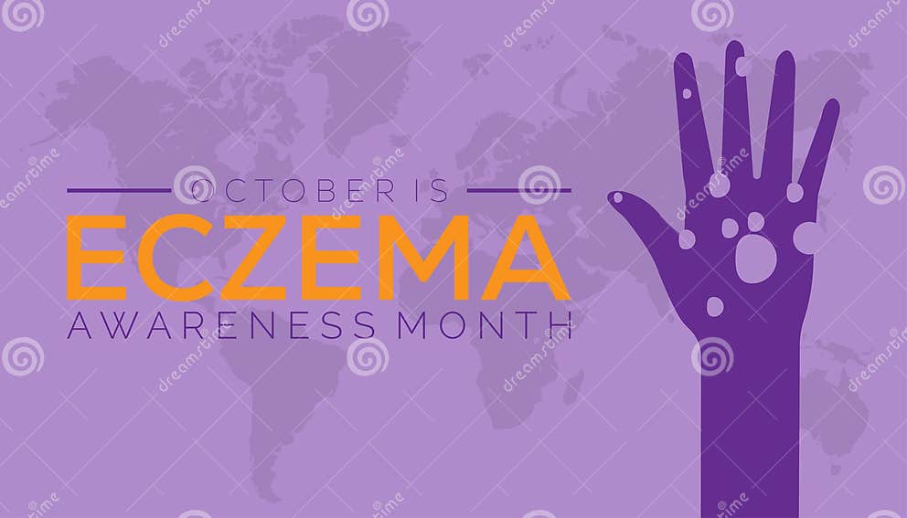 Eczema Awareness Month is Observed Every Year on October. Stock ...