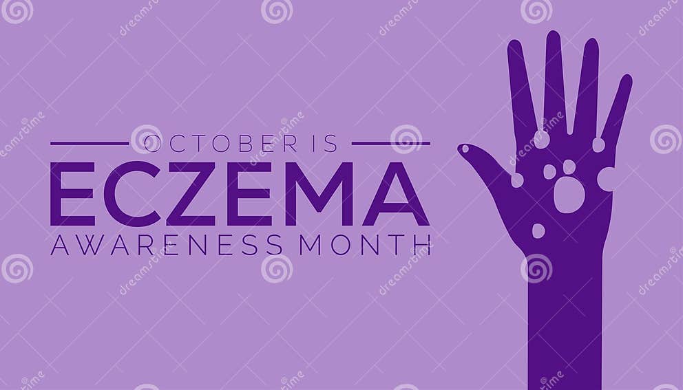 Eczema Awareness Month is Observed Every Year on October. Stock Vector ...