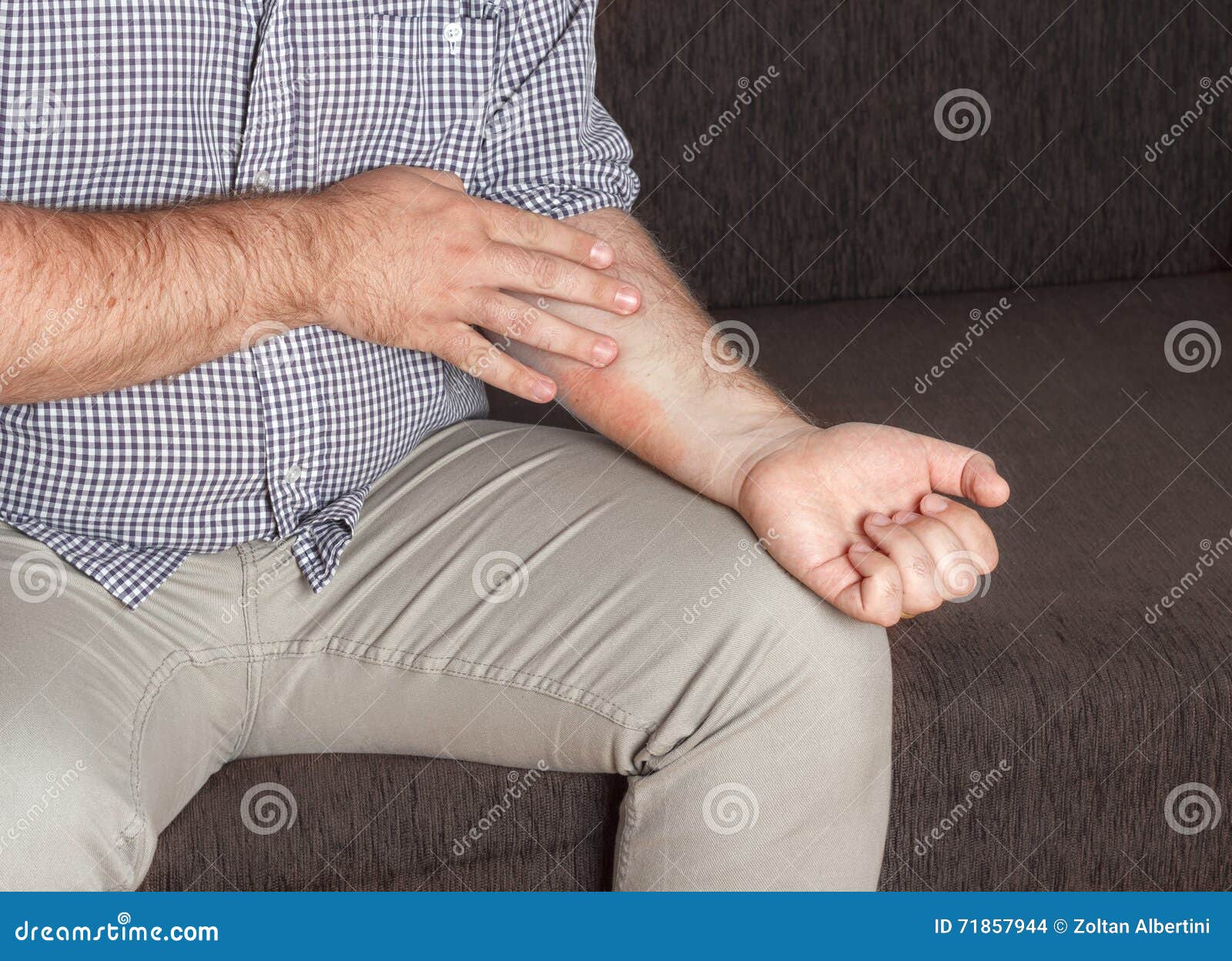 Eczema, medical stock photo. Image of human, stress, psoriasis - 71857944