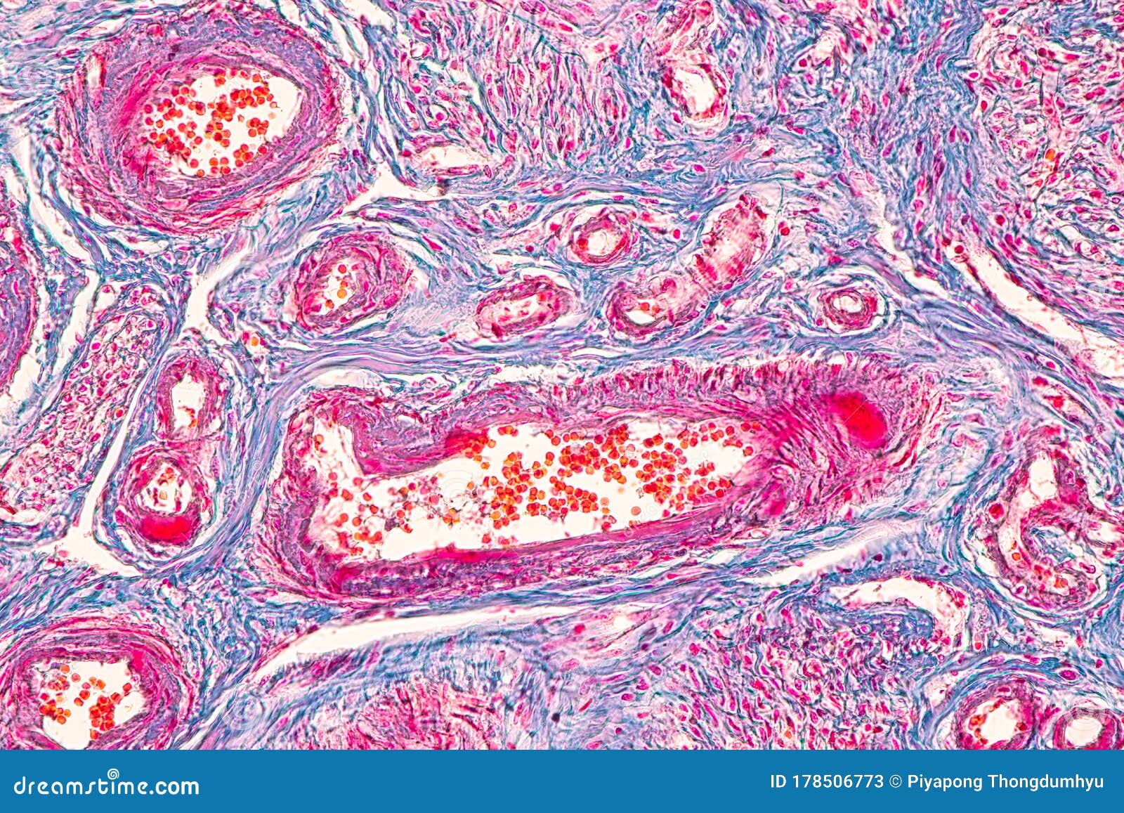 Education Anatomy and Histological Sample of Human Stock Image - Image ...