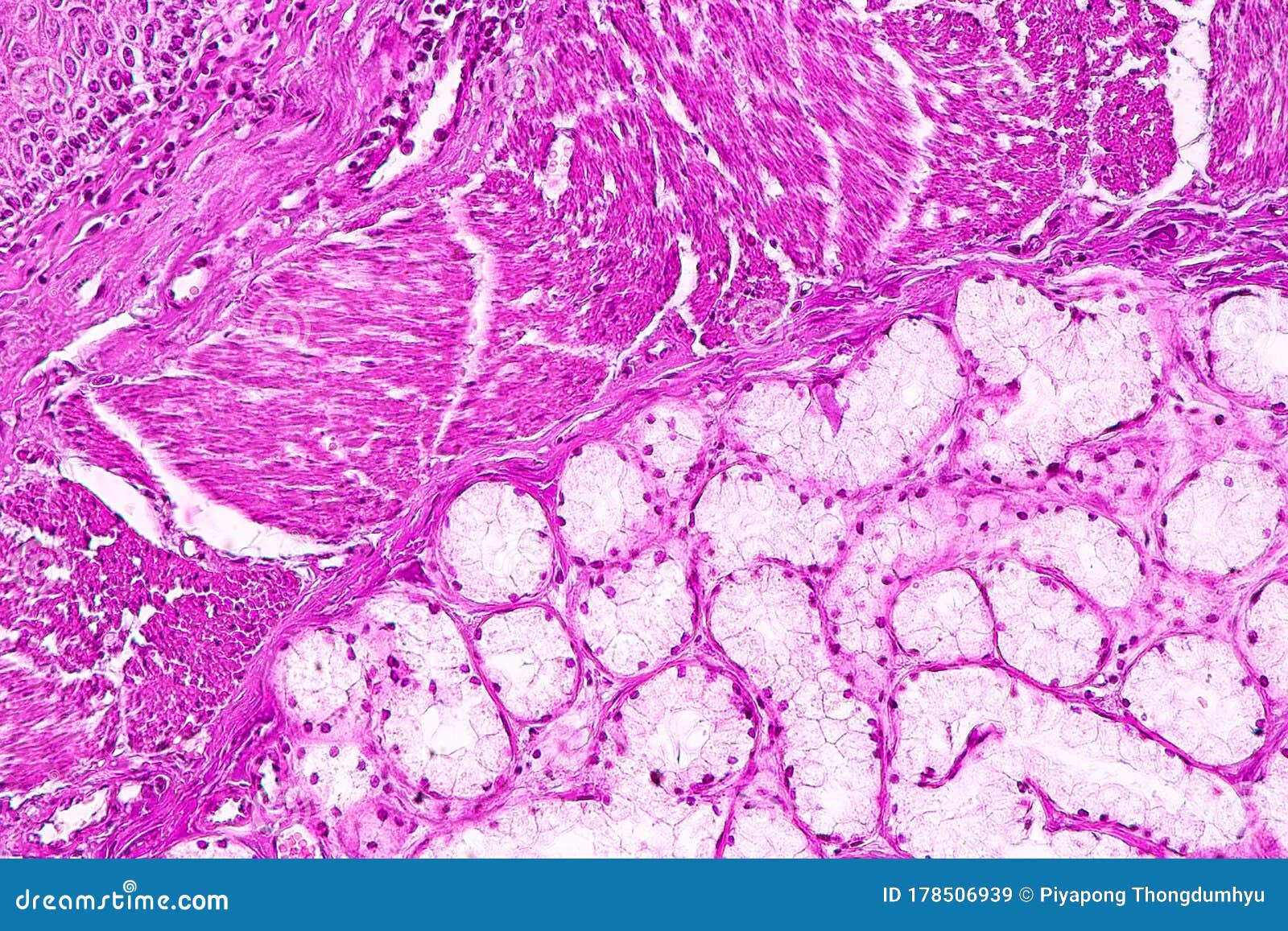 Education Anatomy and Histological Sample of Human Stock Image - Image ...
