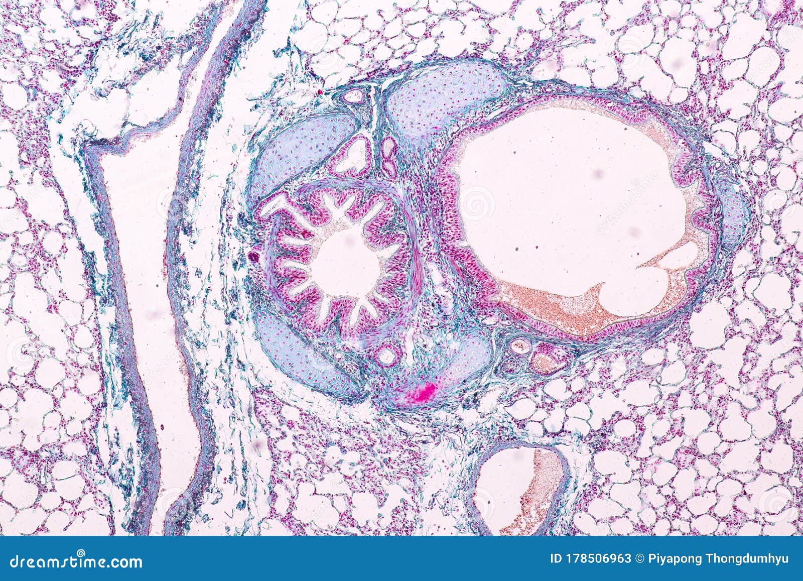 Education Anatomy And Histological Sample Of Muscle Tissue And Adipose ...
