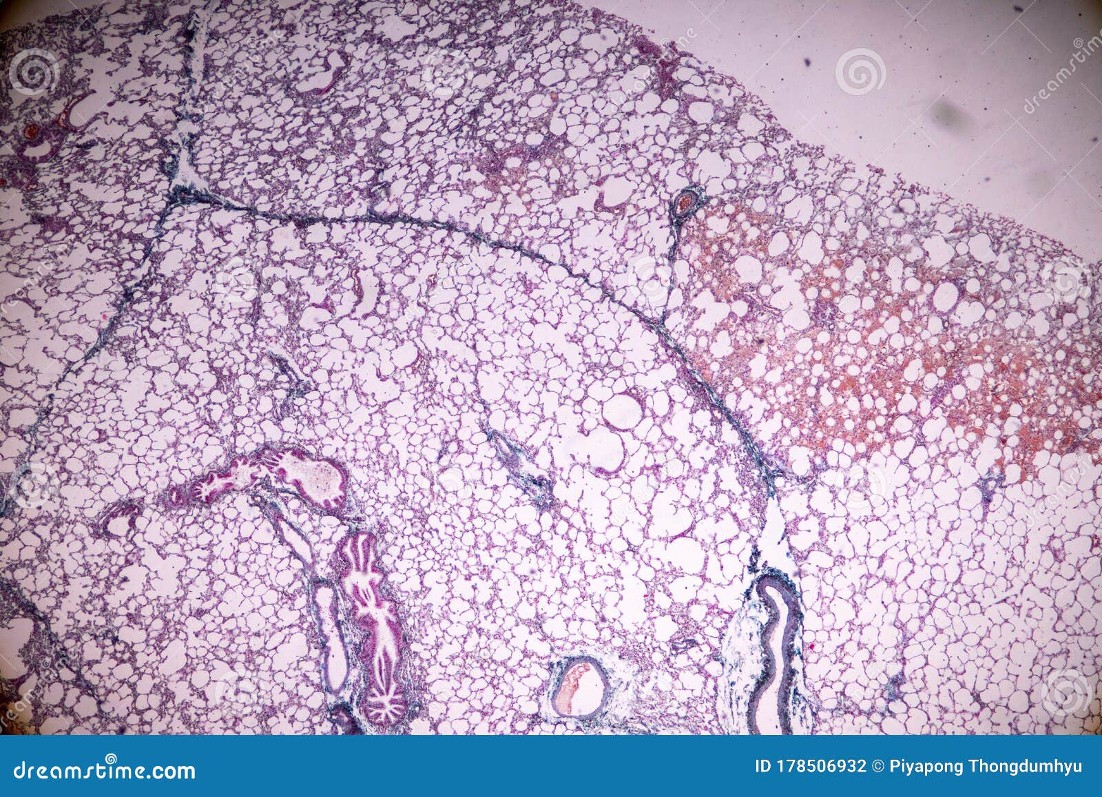 Education Anatomy and Histological Sample of Human Stock Photo - Image ...