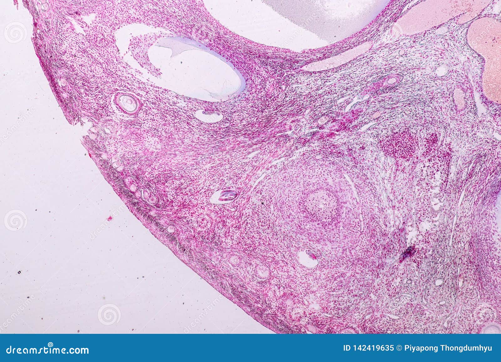 Histological Sample Ovary of Rabbit Tissue Under the Microscope. Stock ...