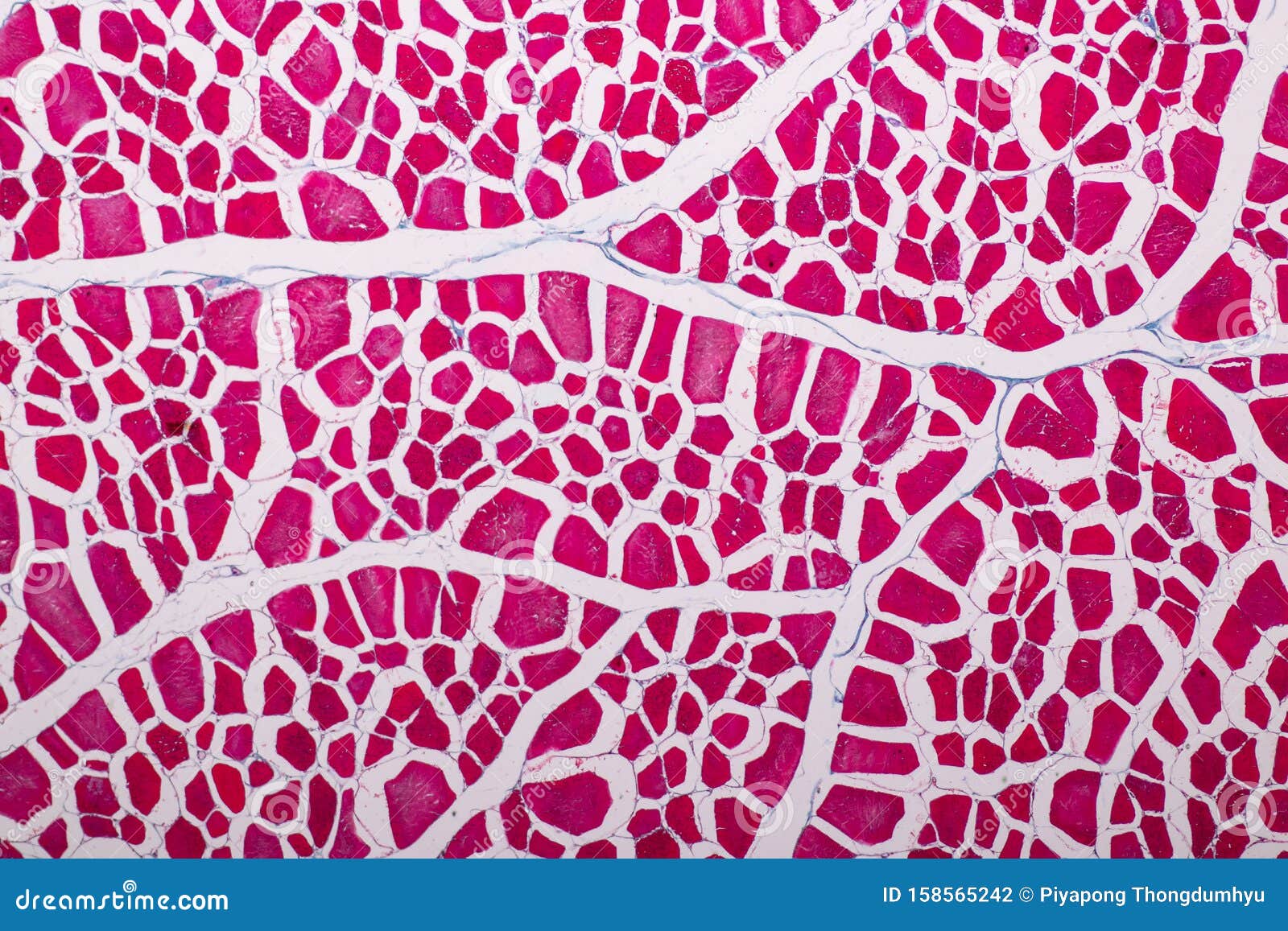 Histological Sample Striated Muscle Tissue Under the Microscope. Stock ...