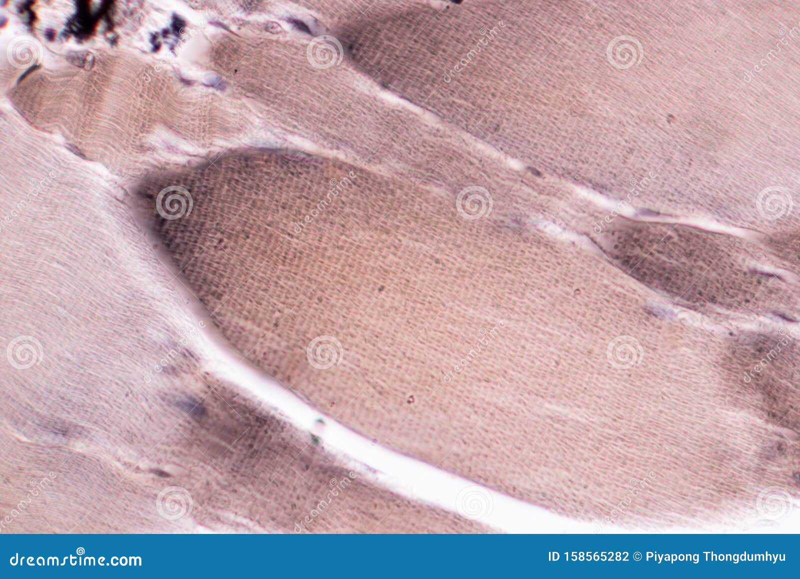 Histological Sample Striated Muscle Tissue Under the Microscope. Stock ...