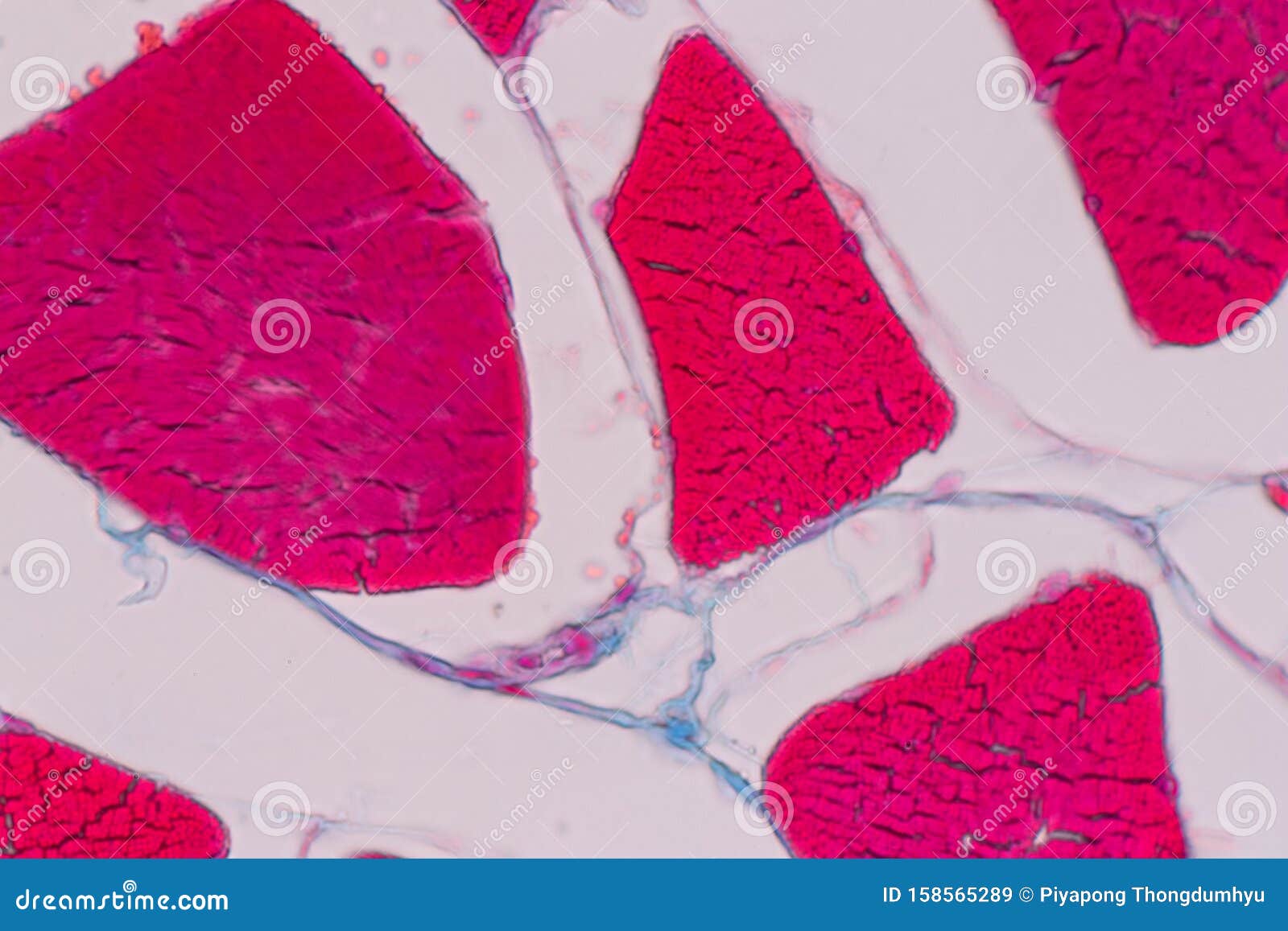 Histological Sample Striated Muscle Tissue Under the Microscope. Stock ...