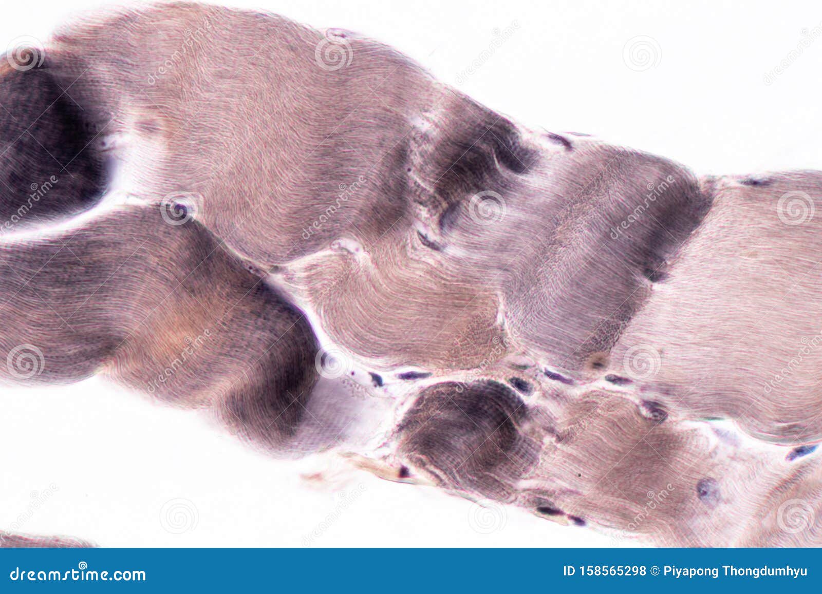 Histological Sample Striated Muscle Tissue Under The Microscope ...
