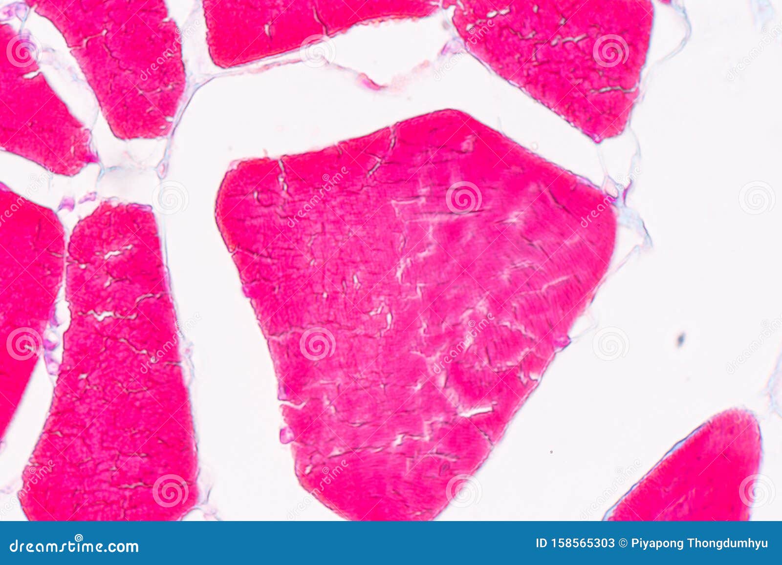 Histological Sample Striated Muscle Tissue Under the Microscope. Stock ...