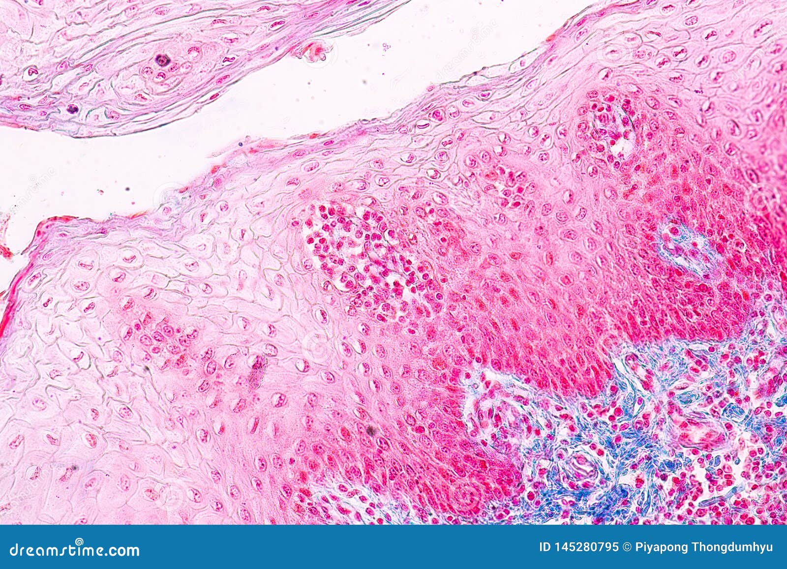 Tongue Cells Under The Microscope Stock Photography | CartoonDealer.com ...