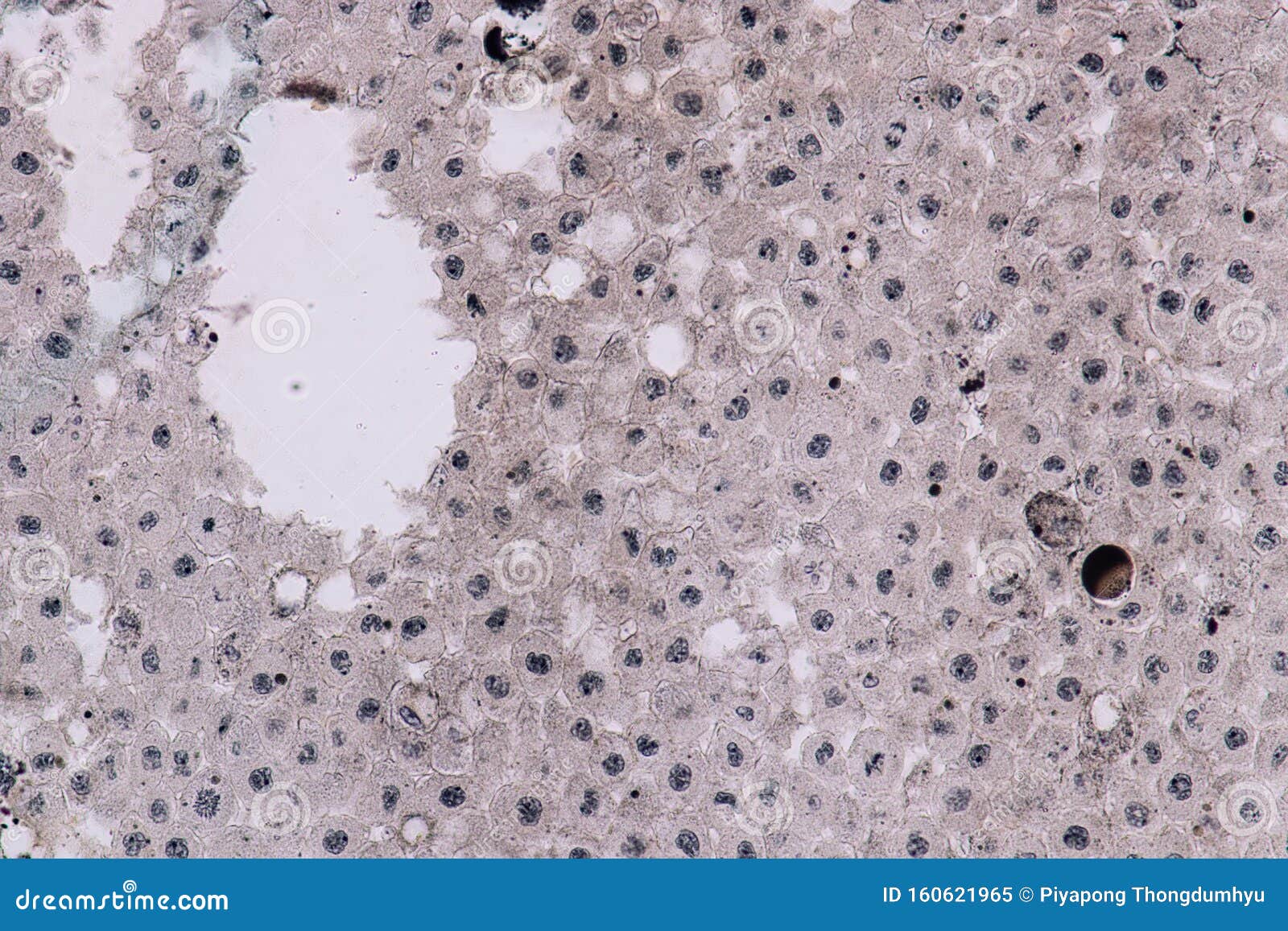 Grasshopper Testis Under the Microscope in Lab. Stock Image - Image of ...