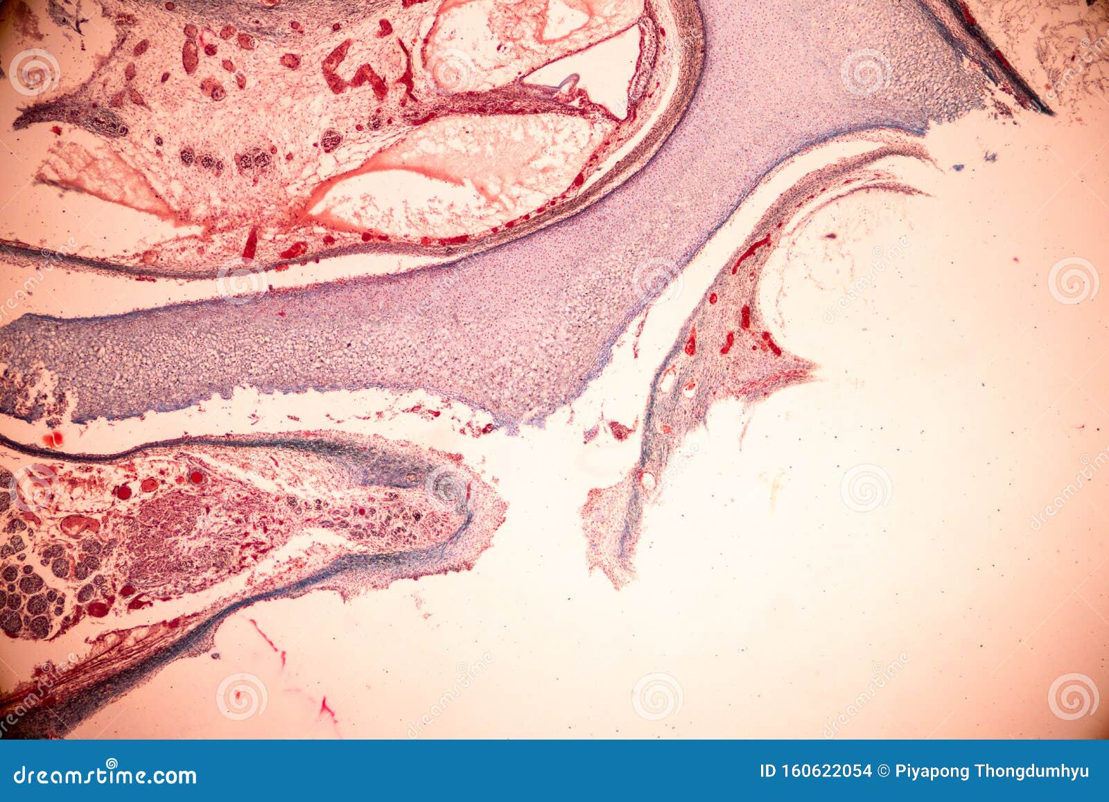 Internal Ear, Foetal Under the Microscope in Lab. Stock Photo - Image ...
