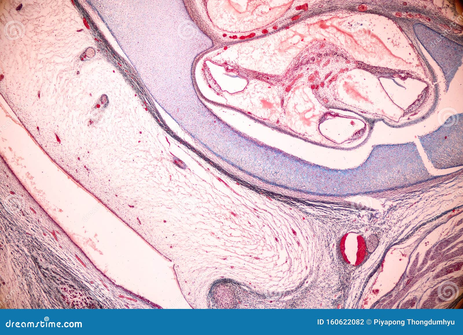 Internal Ear, Foetal Under the Microscope in Lab. Stock Photo - Image ...