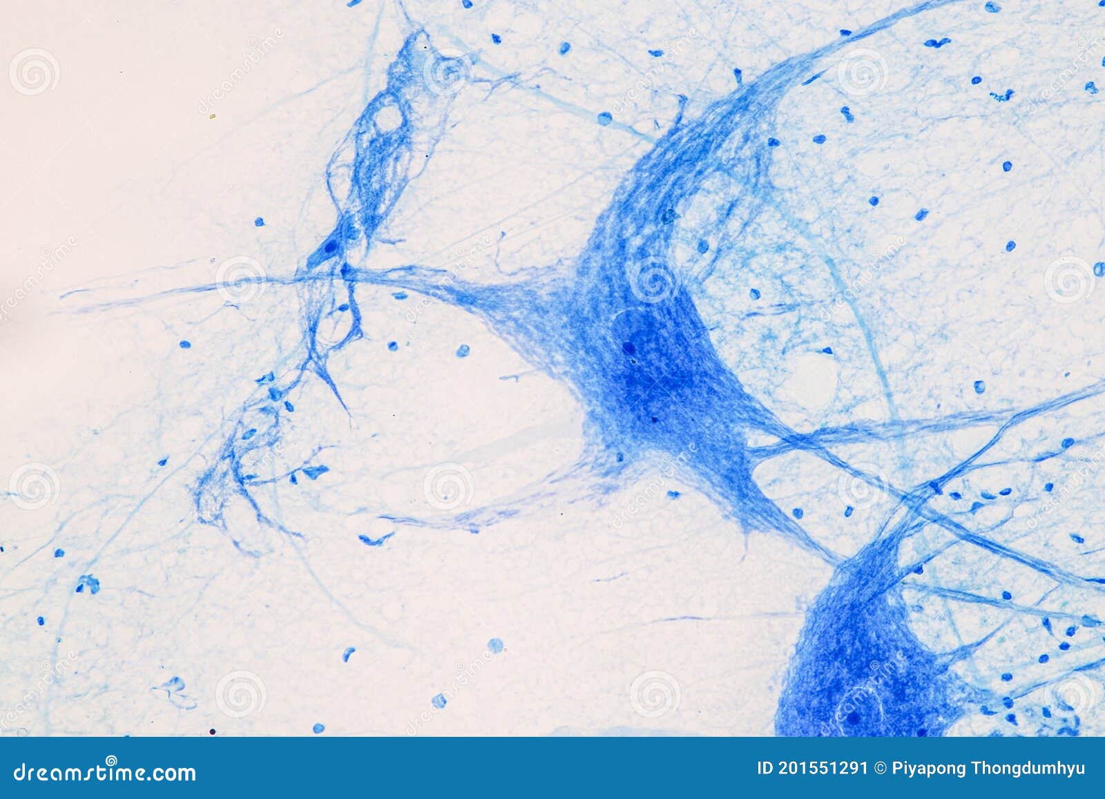 Motor Neuron Under the Microscope. Stock Image - Image of horn, cord ...