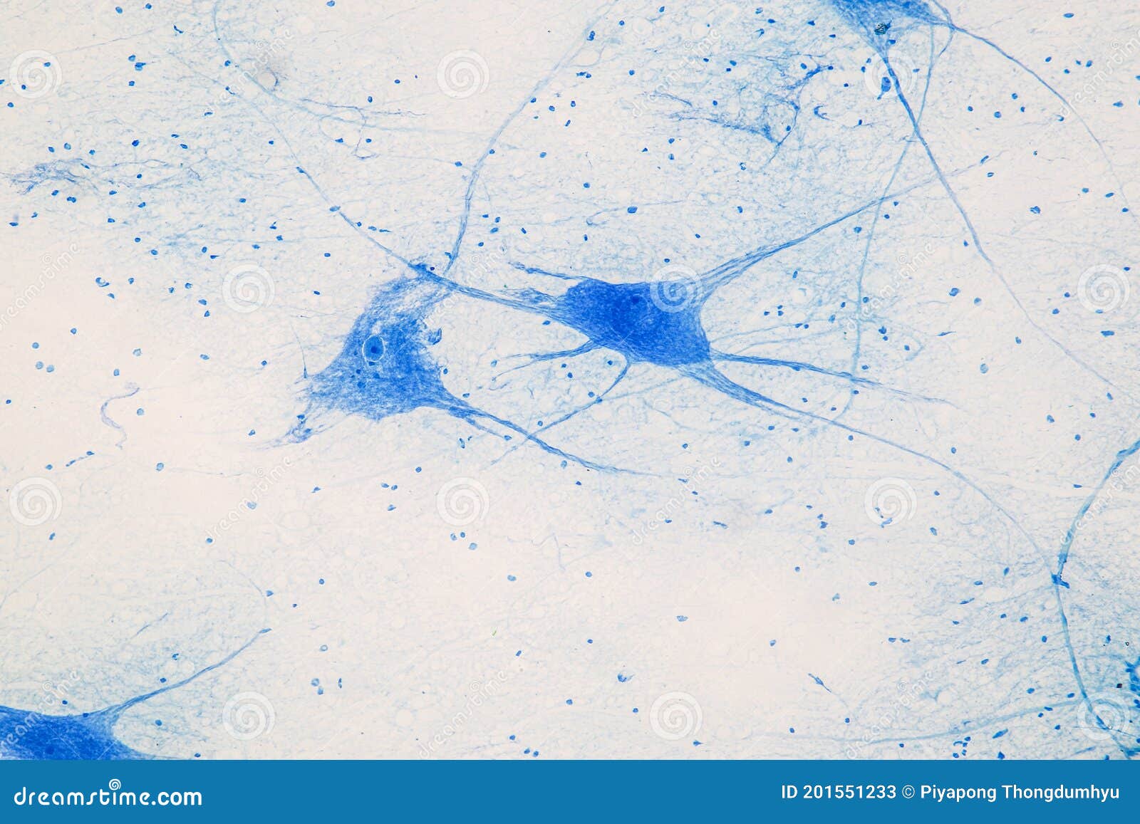 Motor Neuron Under the Microscope. Stock Image - Image of cord, impulse ...