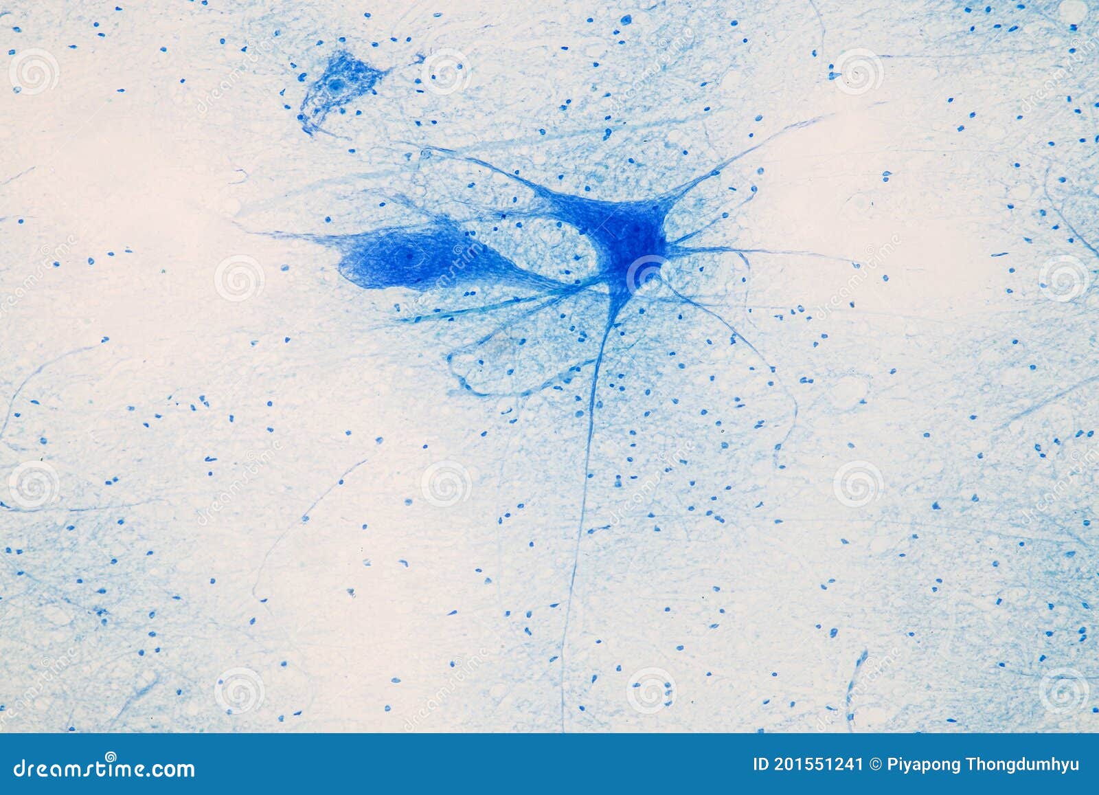 Motor Neuron Under the Microscope. Stock Image - Image of microscope ...
