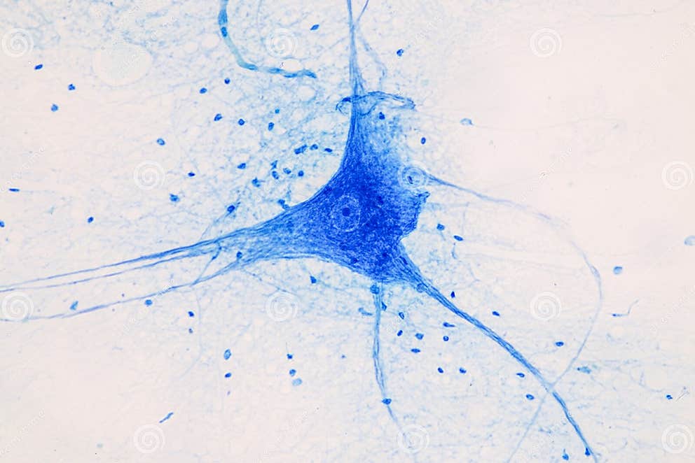 Motor Neuron Under the Microscope. Stock Image - Image of brain ...