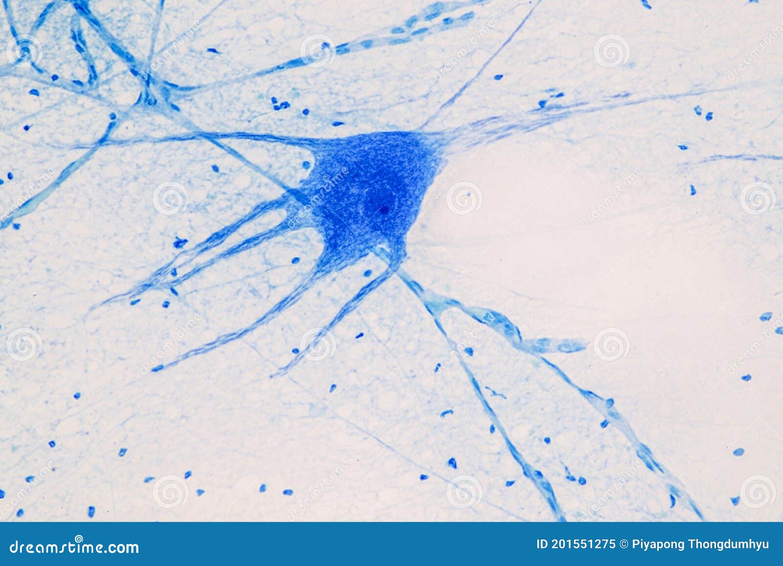 Motor Neuron Under the Microscope. Stock Image - Image of central ...