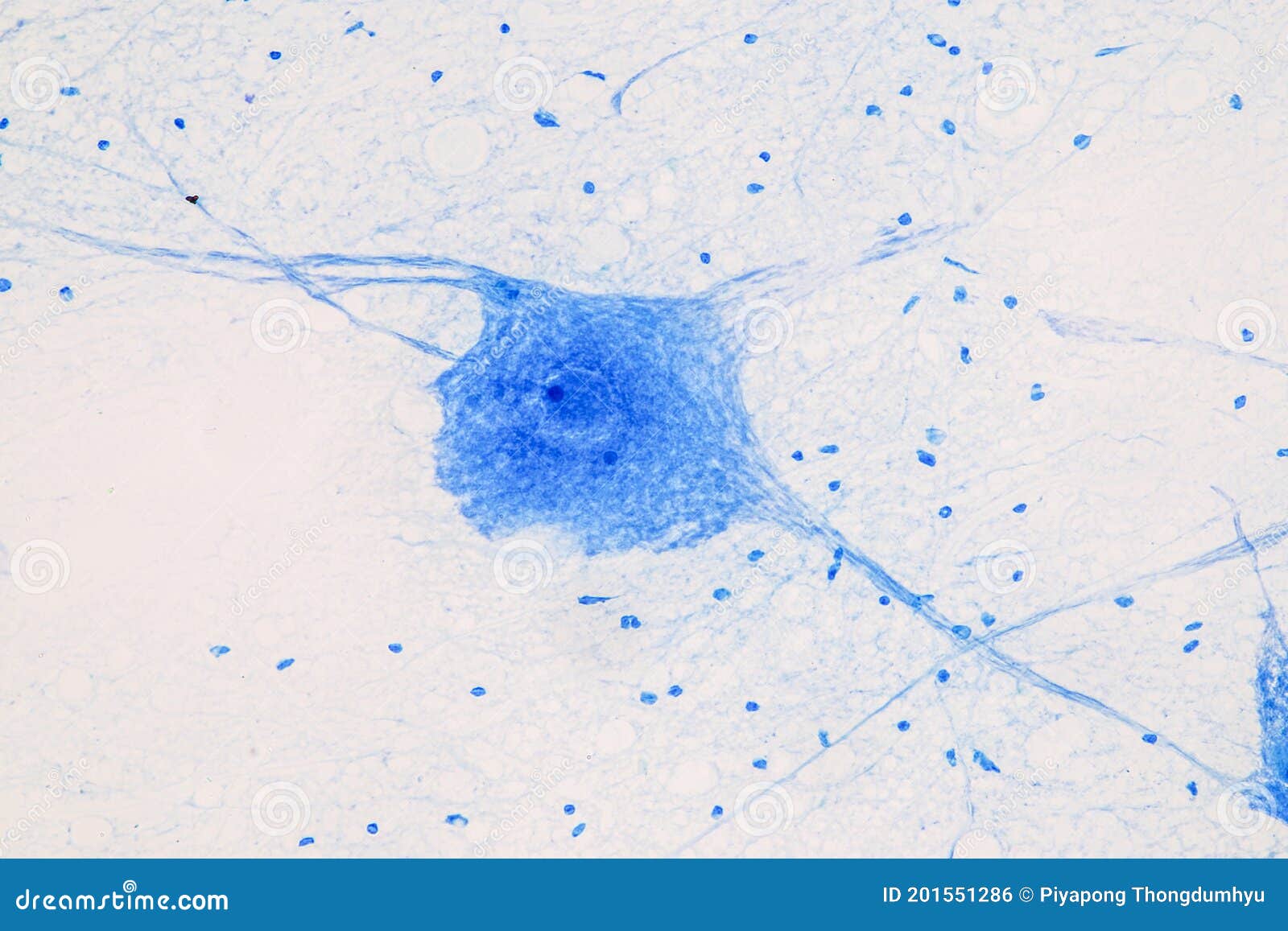 Motor Neuron Under the Microscope. Stock Photo - Image of histological ...
