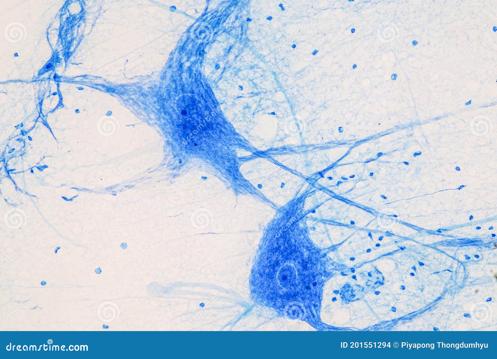 Motor Neuron Under the Microscope. Stock Photo - Image of central ...