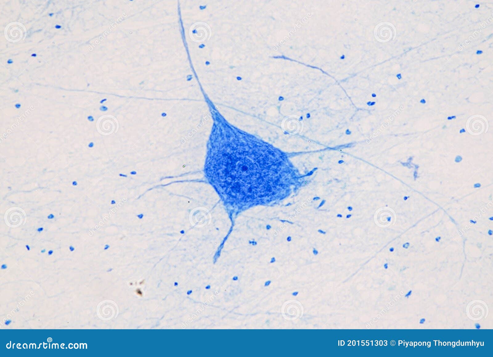 Motor Neuron Under the Microscope. Stock Image - Image of cord, labn ...