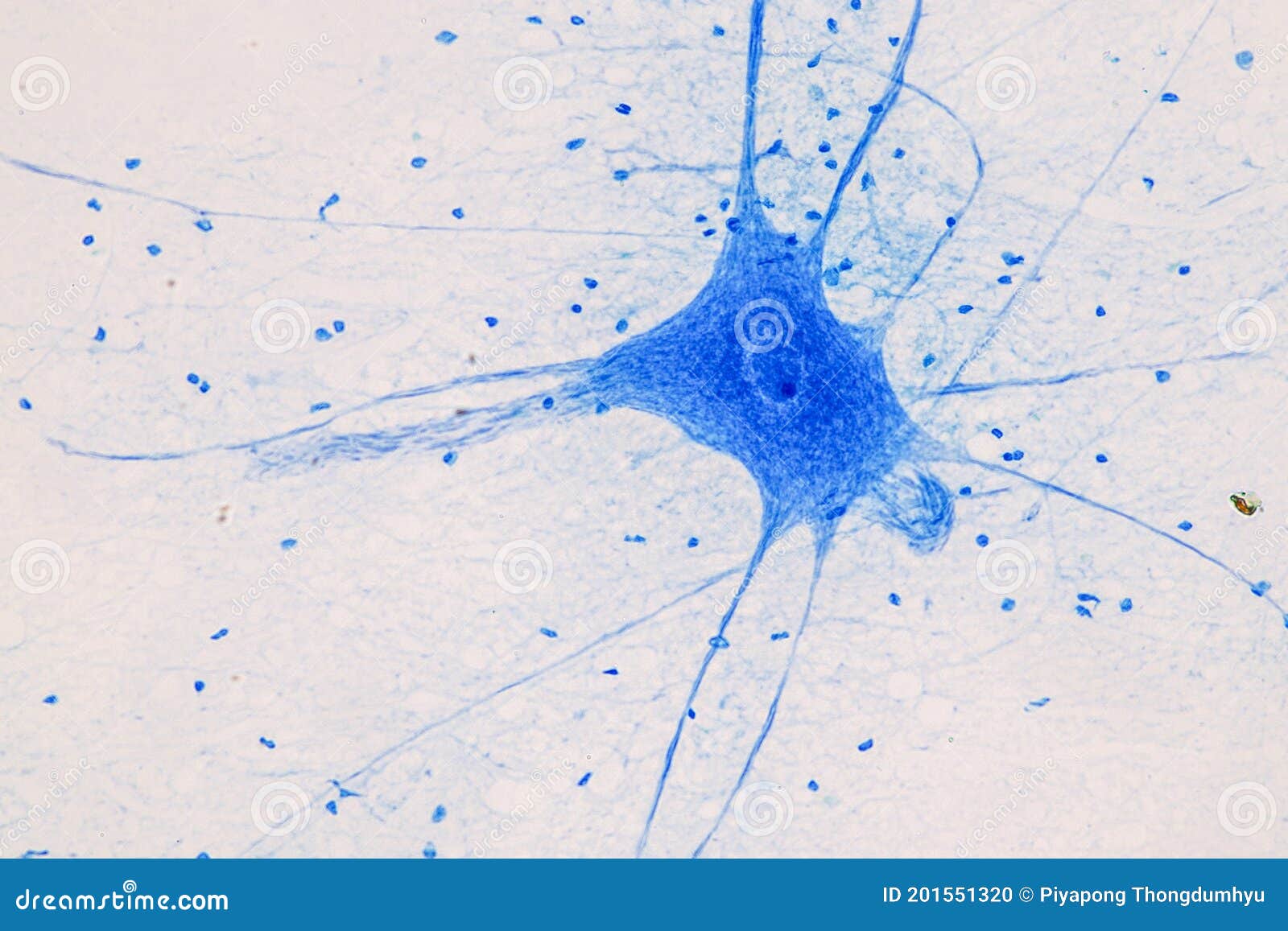 Motor Neuron Under the Microscope. Stock Photo - Image of cord, motor ...