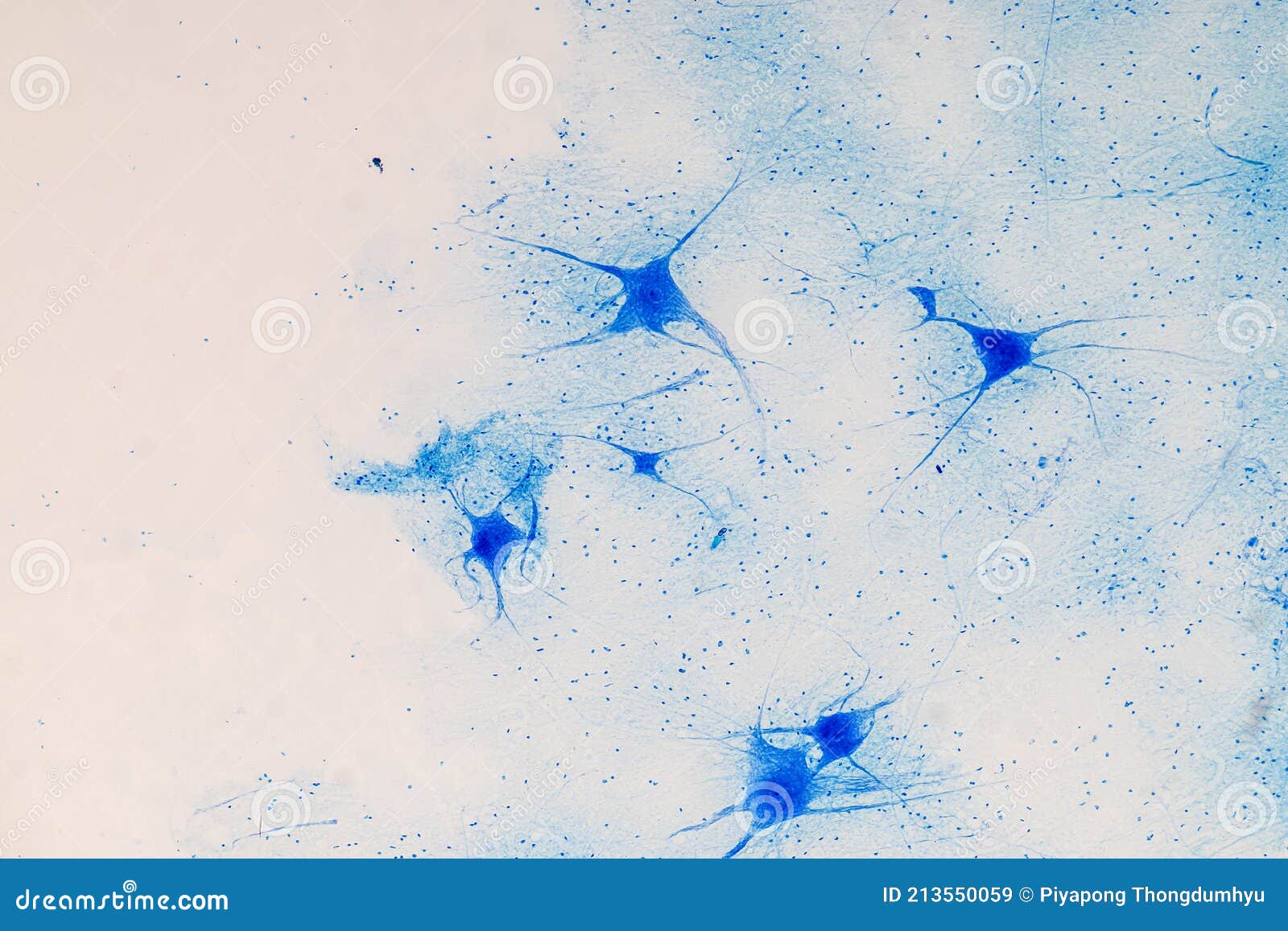Spinal Cord and Motor Neuron Under the Microscope in Lab. Stock Image ... Spinal Cord and Motor Neuron Under the Microscope in Lab. Stock Image ...